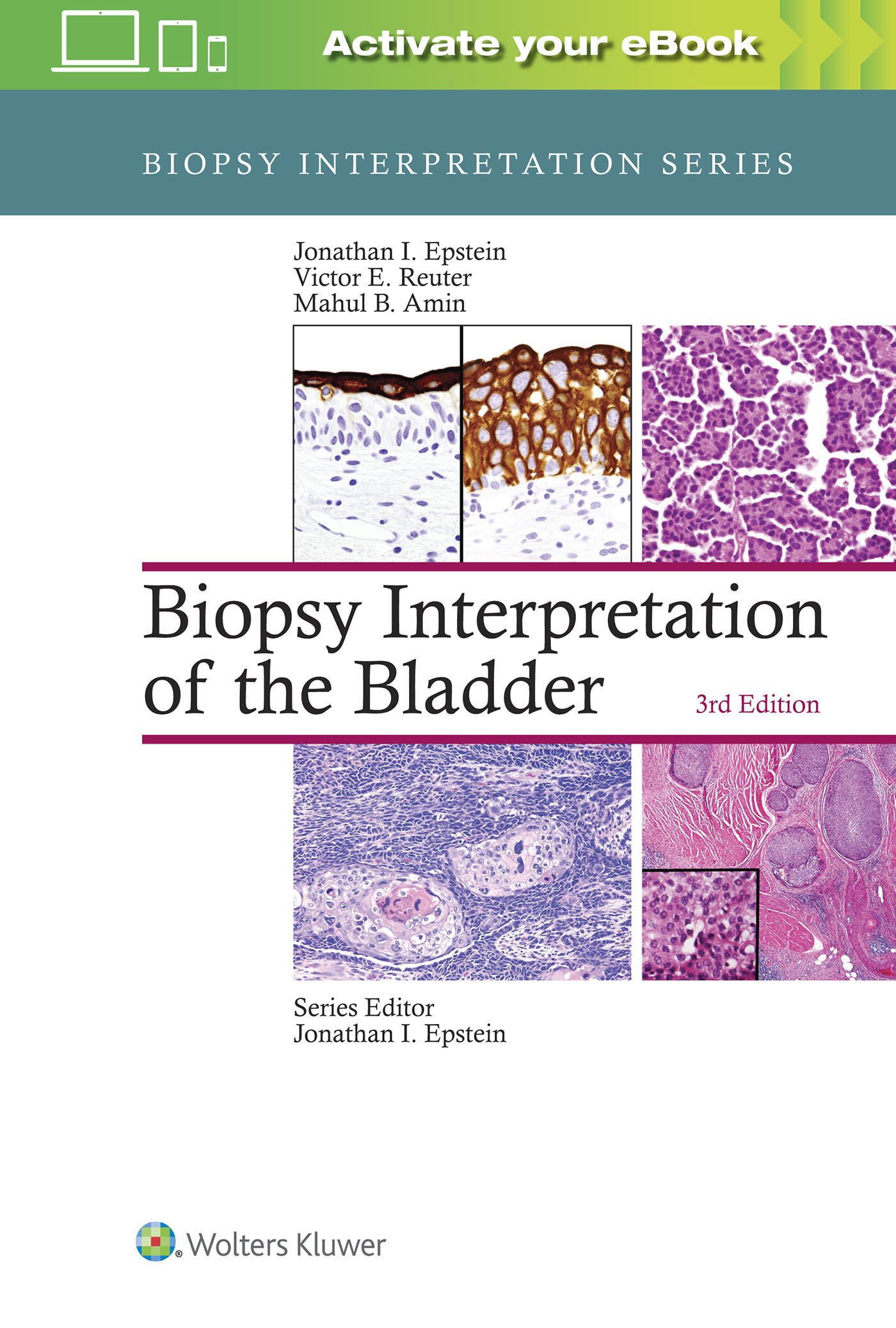 Amazon | Biopsy Interpretation of the Bladder (Biopsy Interpretation ...