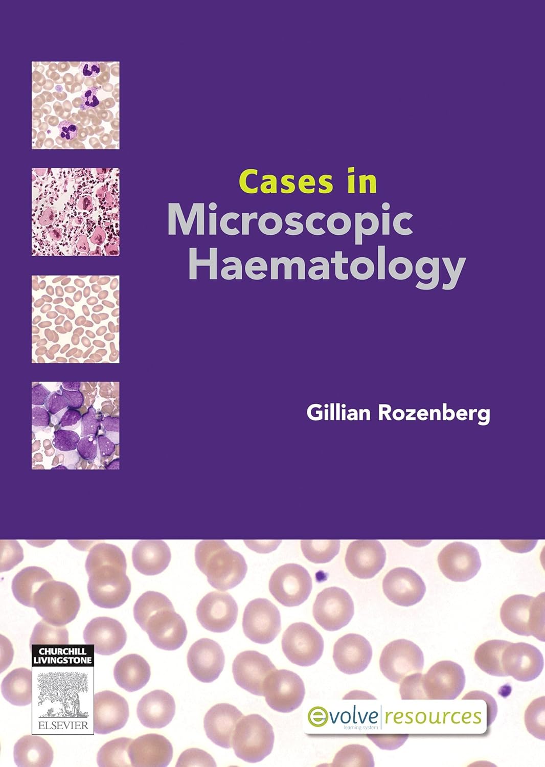 Amazon.com: Cases in Microscopic Haematology - E-Book eBook : Rozenberg ...