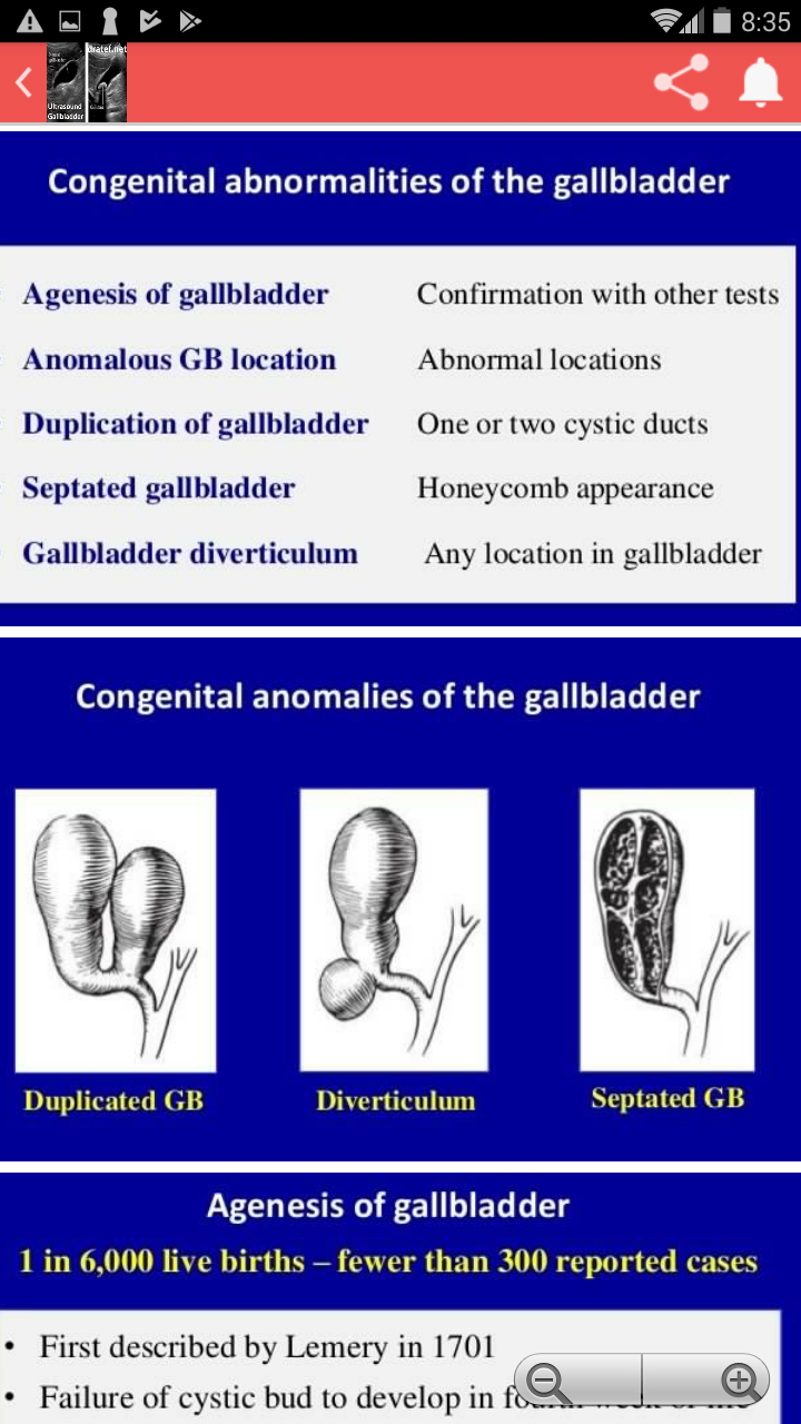 UltraSound Gallbladder - App on Amazon Appstore