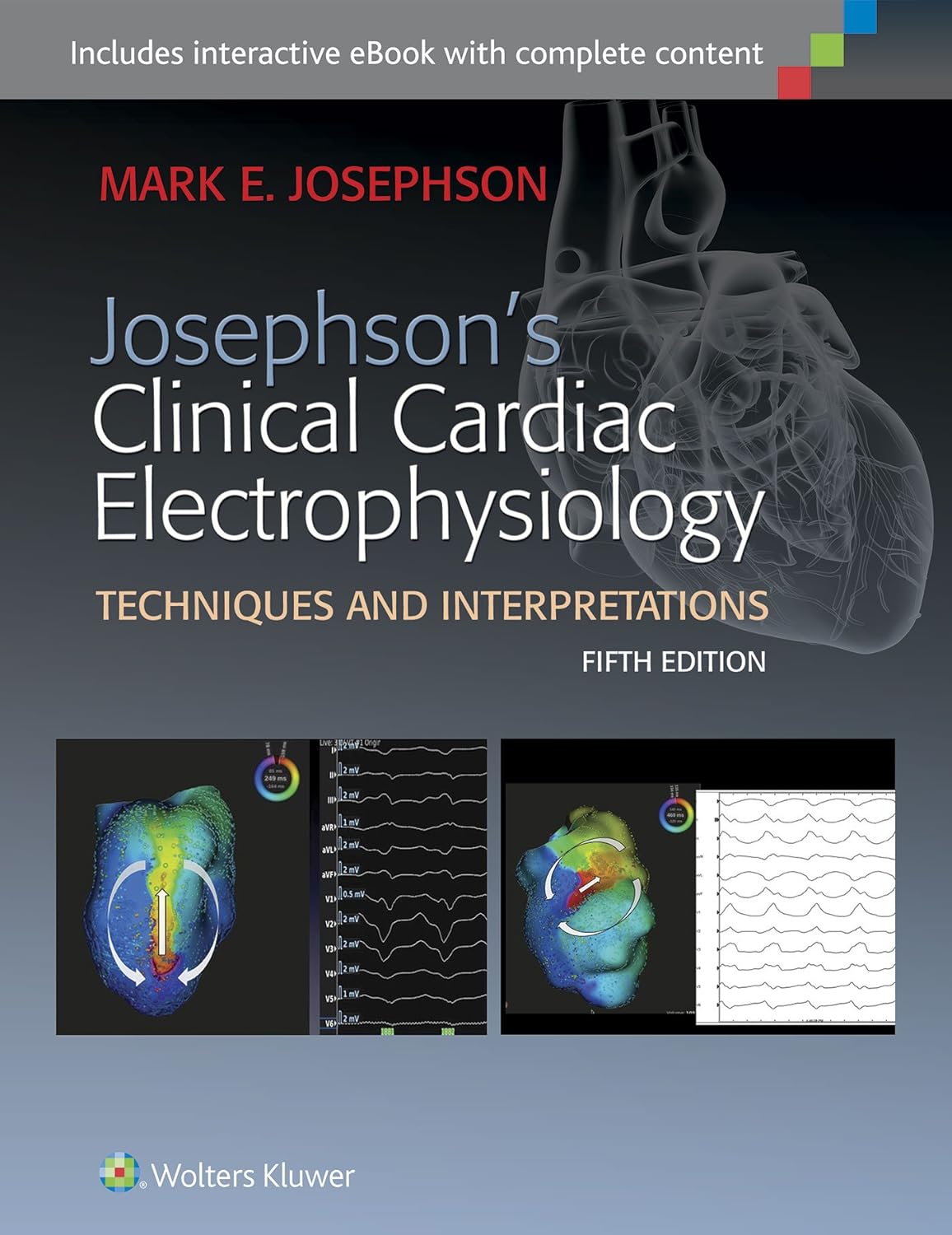 Josephson's Clinical Cardiac Electrophysiology: Josephson MD, Mark E ...