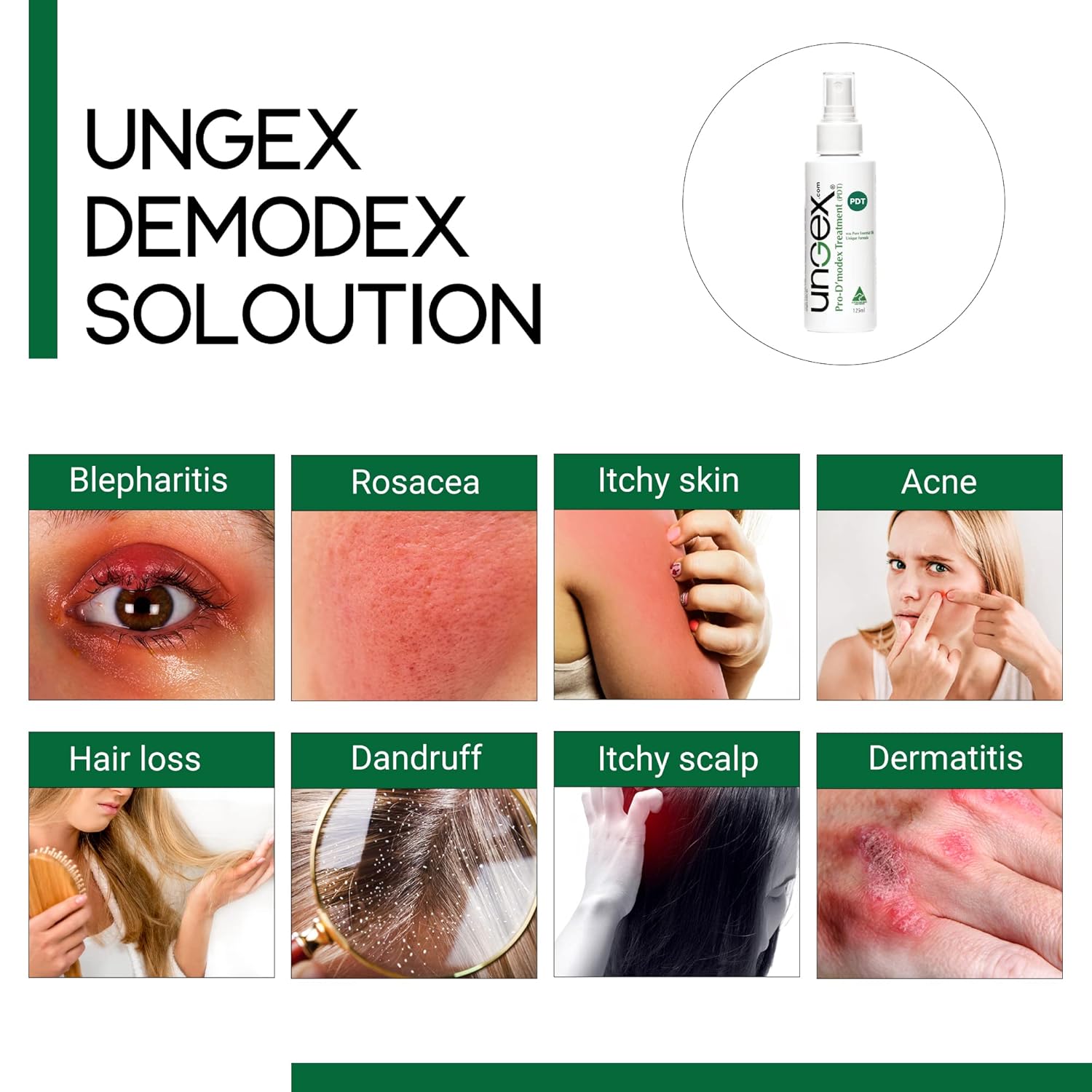 Buy Ungex Superior Kit | Demodex Acne Rosacea Solution | 2 in 1 with ...