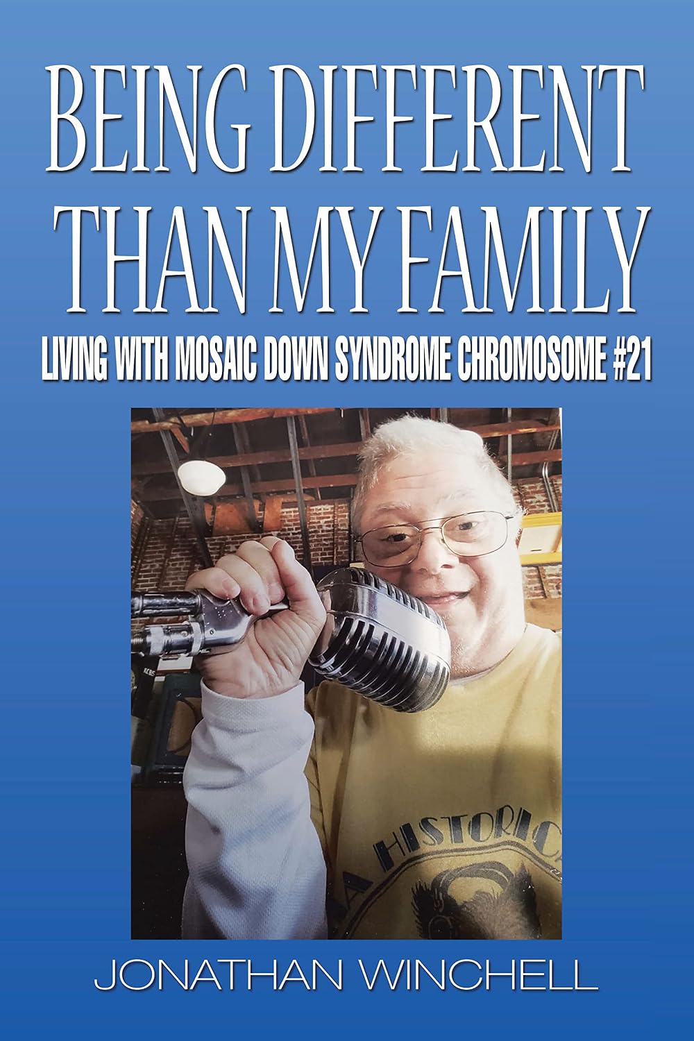 Amazon.com: Being Different Than My Family: Living with Mosaic Down ...
