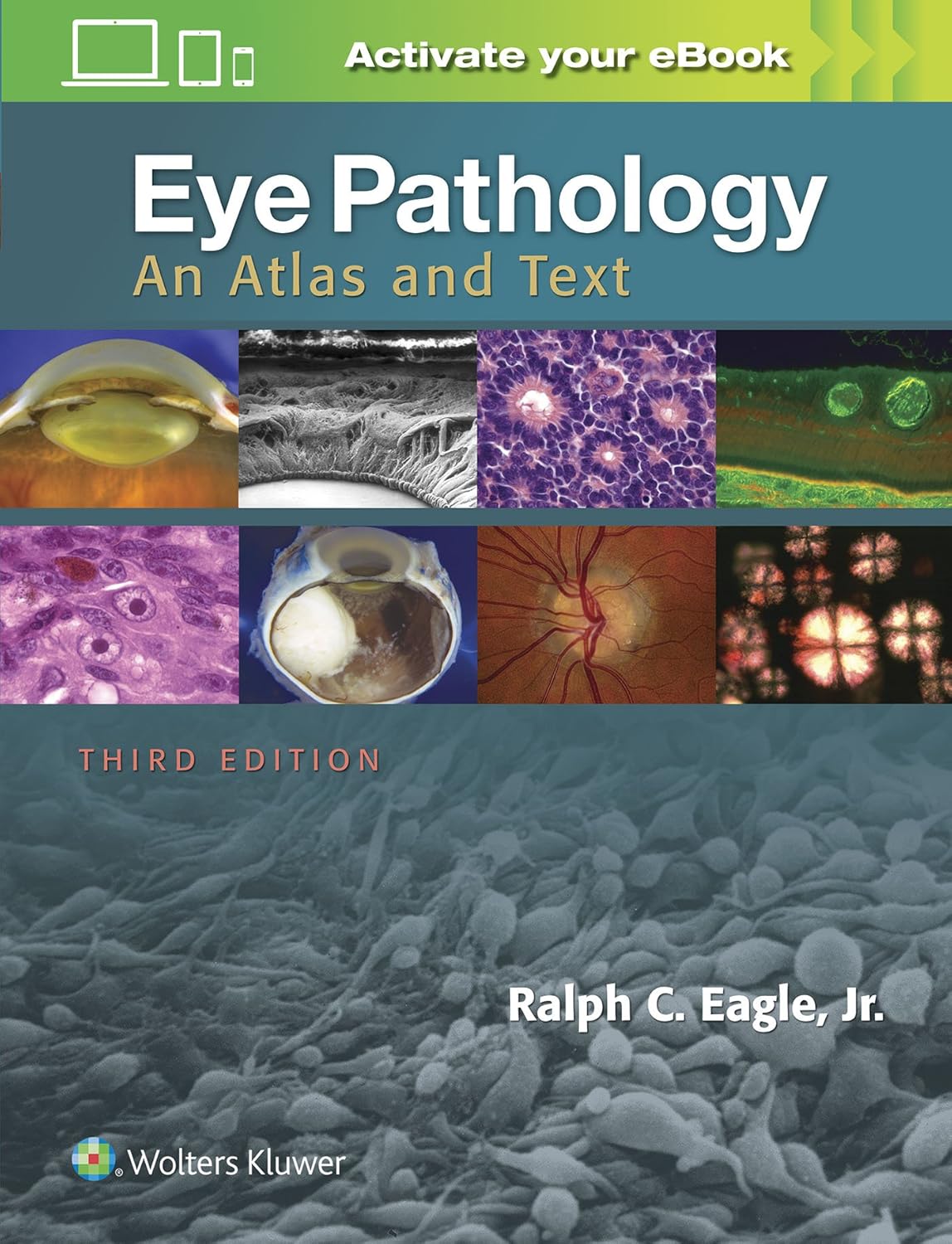 Eye Pathology: An Atlas and Text: 9781496337177: Medicine & Health ...