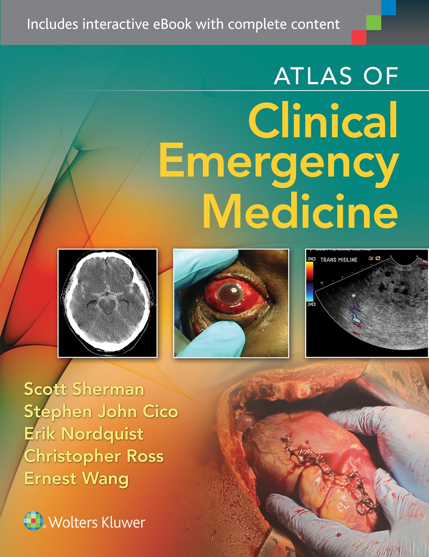 Atlas of Clinical Emergency Medicine: 9781451188820: Medicine & Health ...