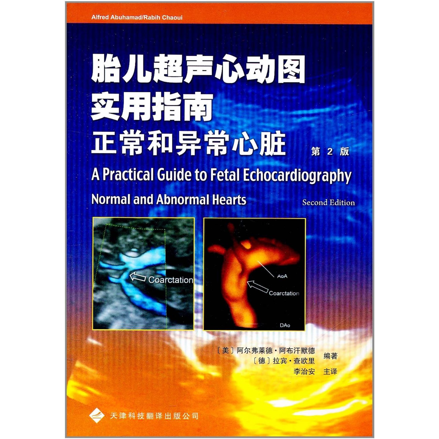 Guide to Ultrasonic Cardiograms for Baby-Normal and abnoramal Hearts ...