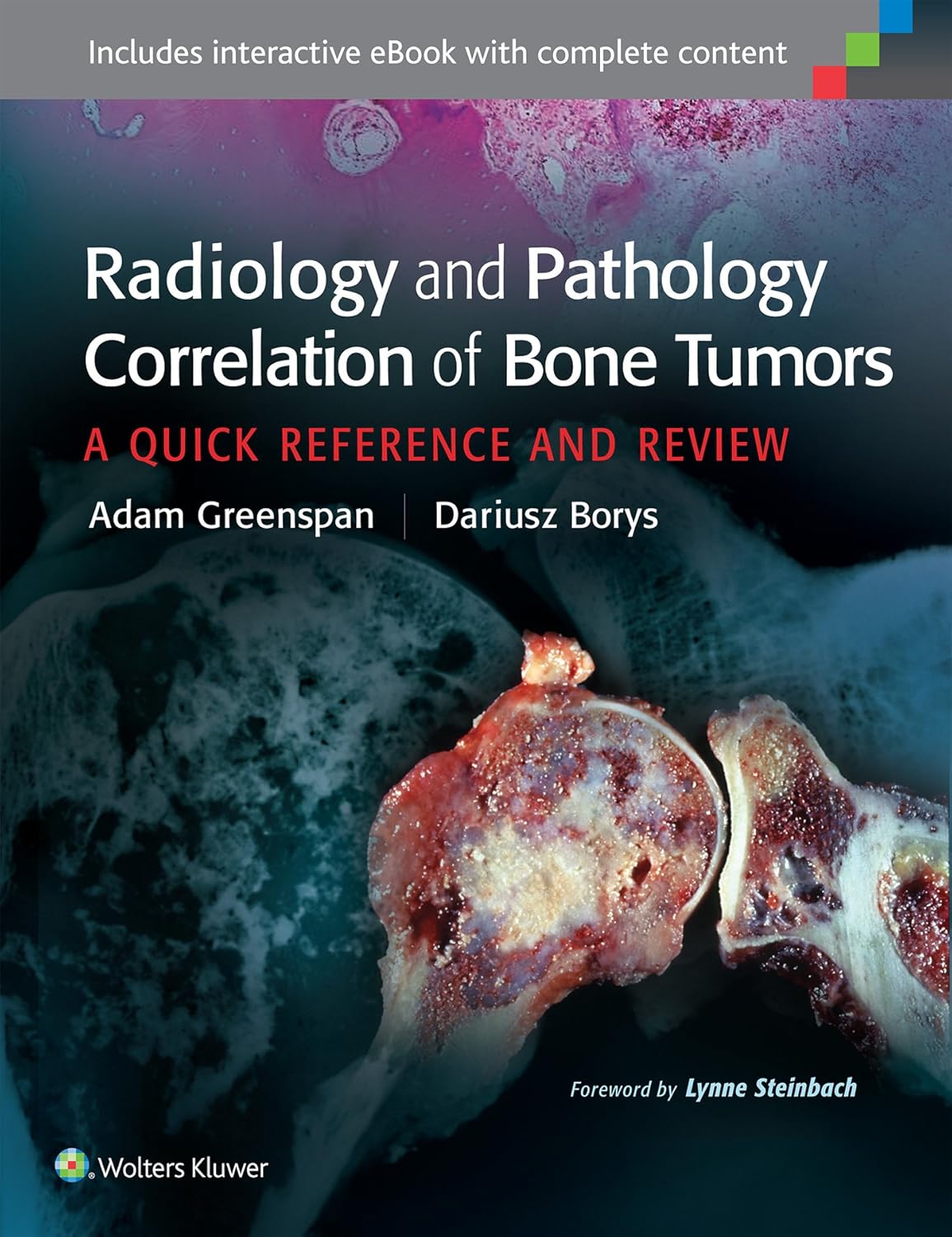 Amazon | Radiology and Pathology Correlation of Bone Tumors: A Quick ...
