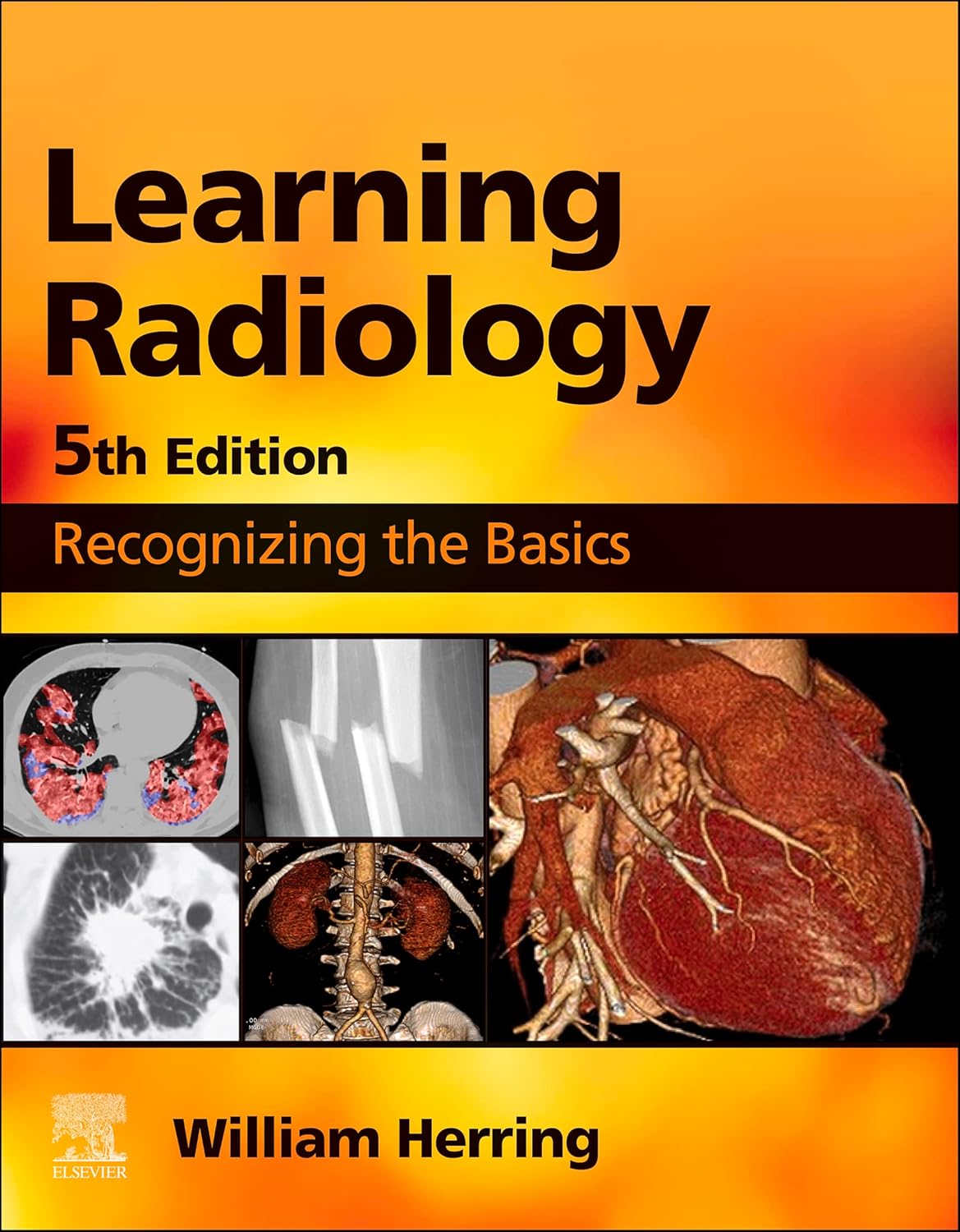 Amazon.com: Learning Radiology E-Book eBook : Herring MD, FACR, William ...