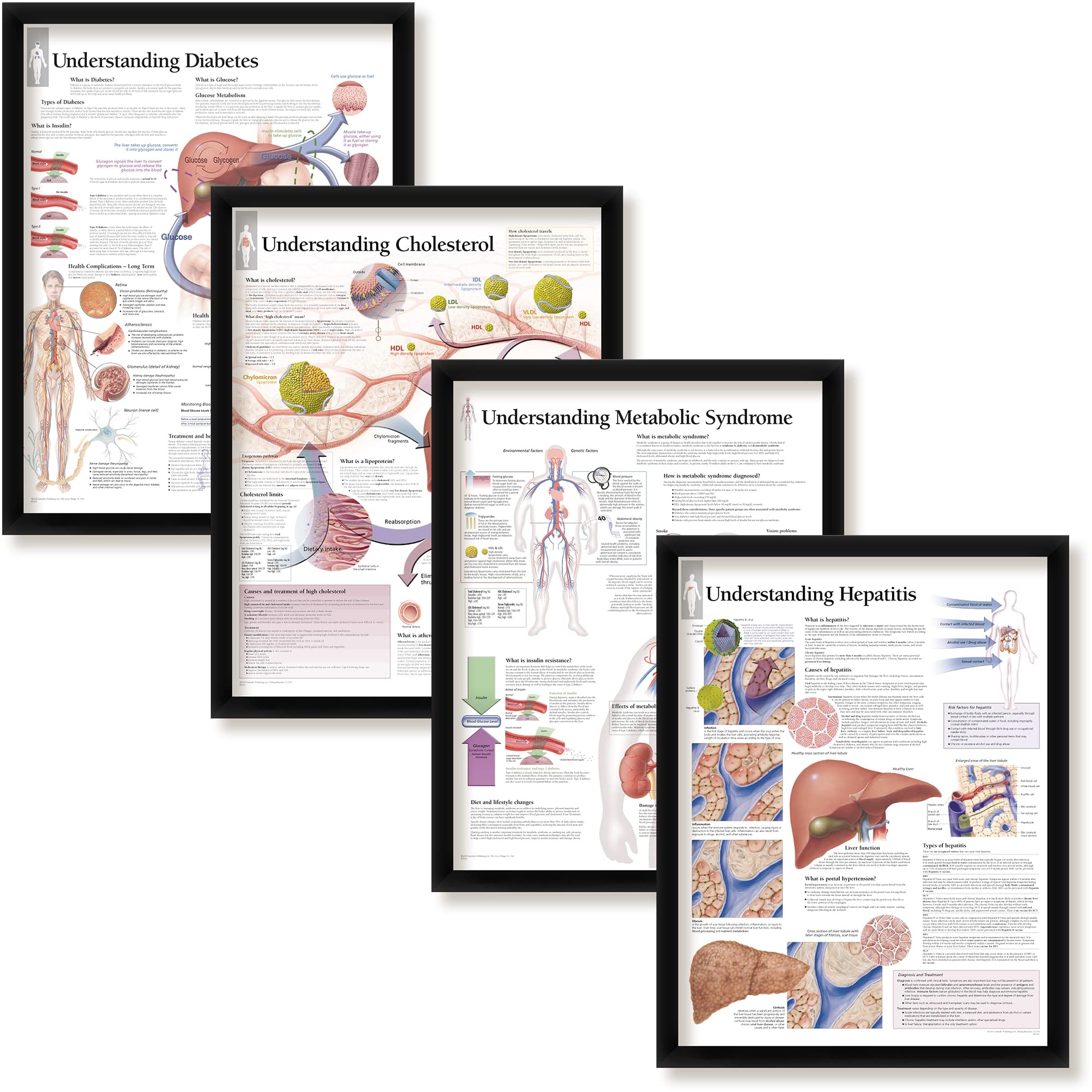 Diabetes Poster Presentation
