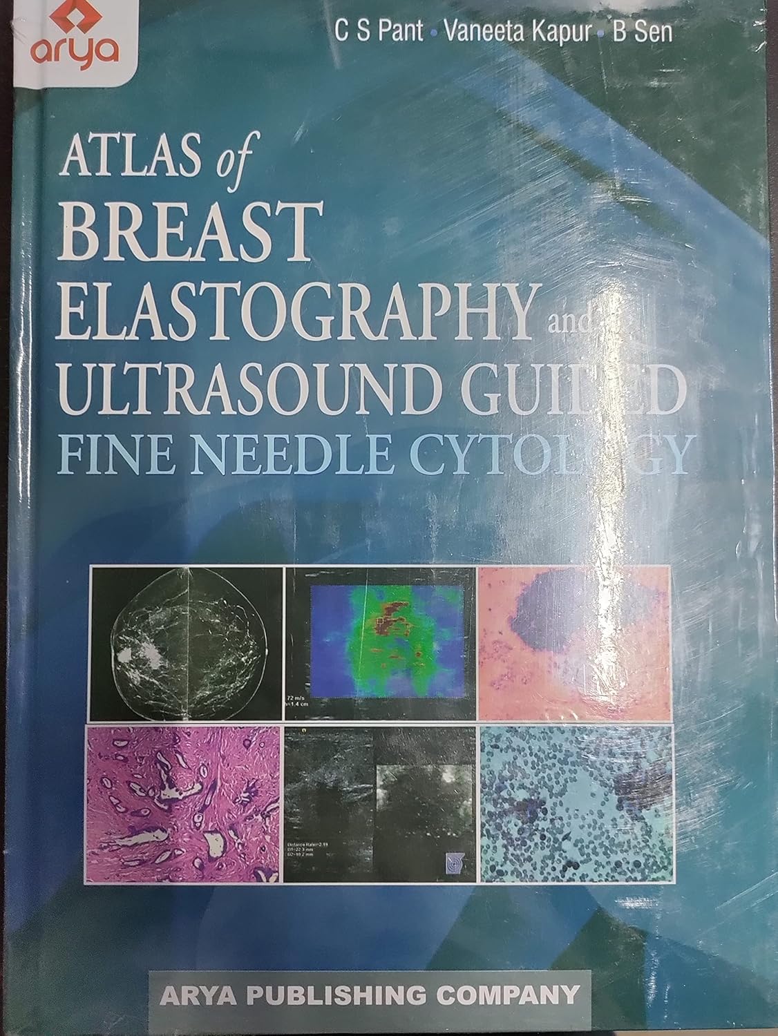Amazon.in: Buy Atlas of Breast Elastography and Ultrasound Guided Fine ...