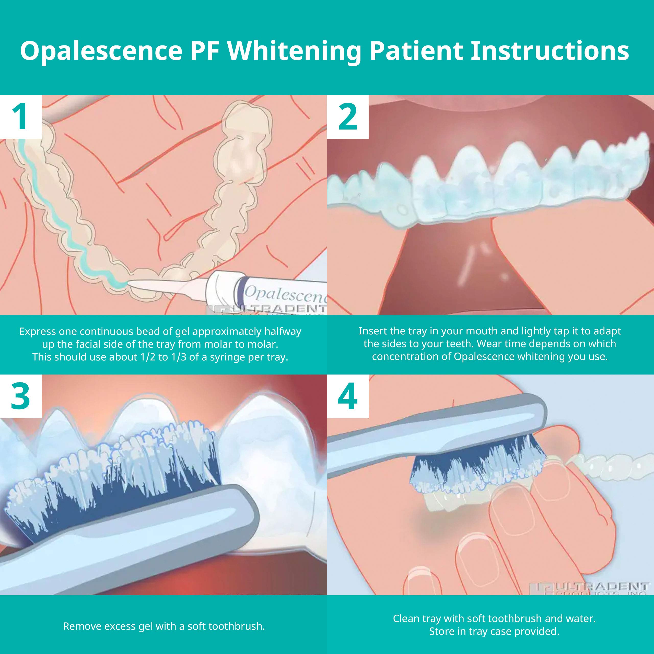 Buy Opalescence at Home Teeth Whitening - Teeth Whitening Gel Syringes ...