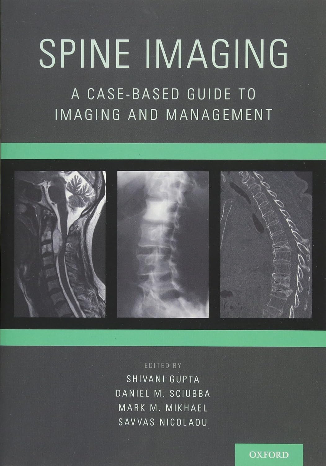 Spine Imaging: A Case-Based Guide to Imaging and Management ...