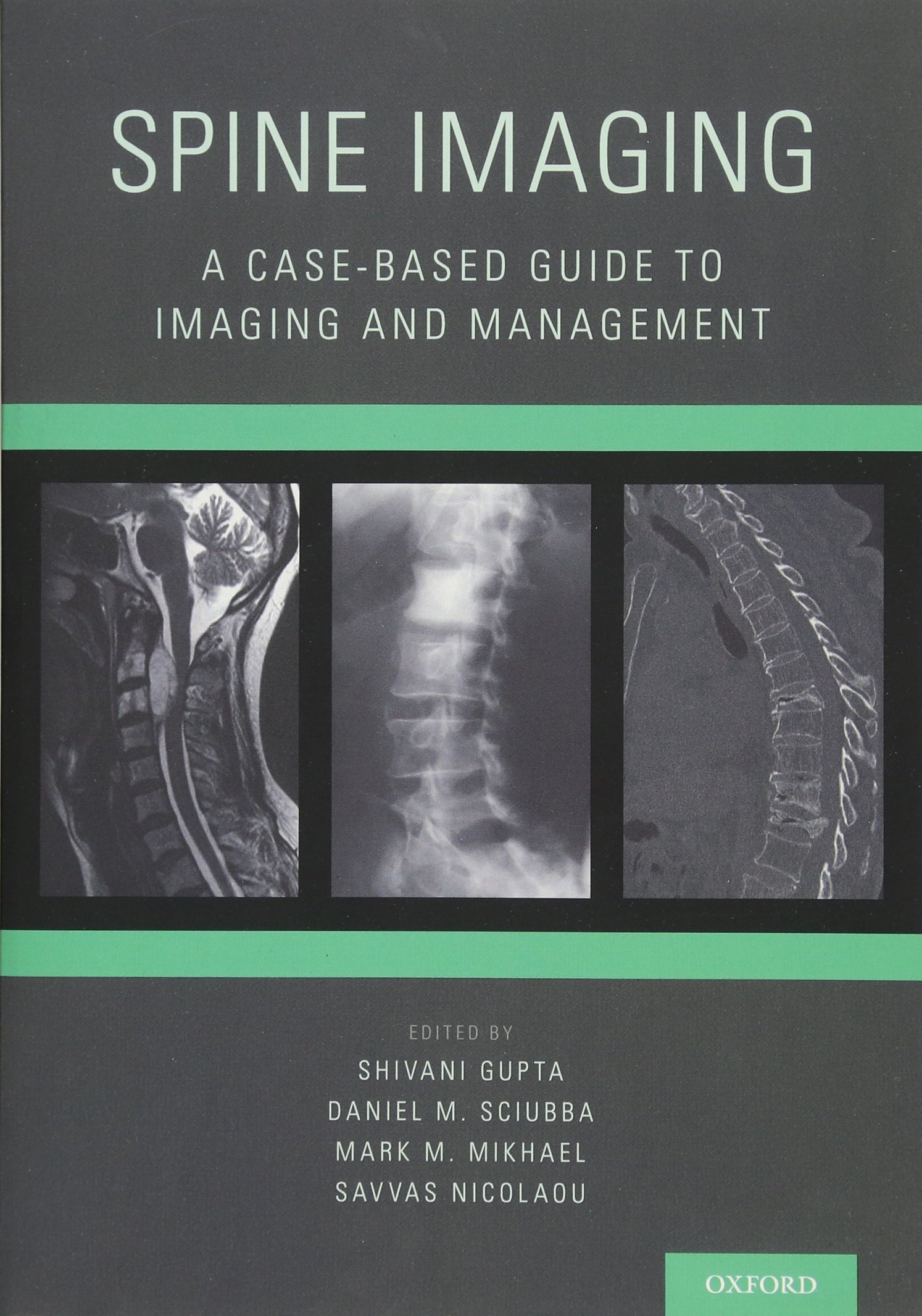 Spine Imaging: A Case-Based Guide to Imaging and Management ...