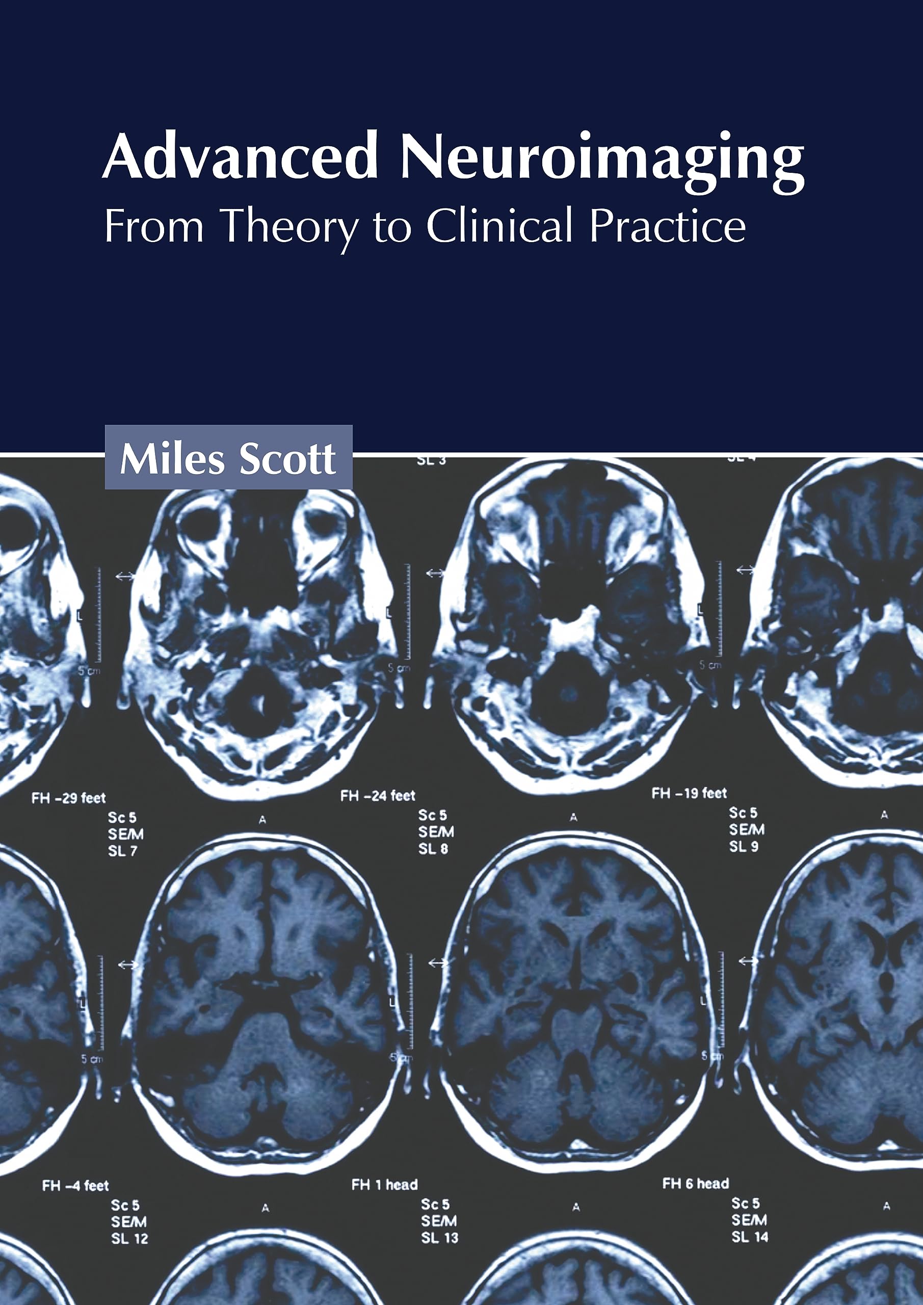 Advanced Neuroimaging: From Theory to Clinical Practice: 9781639278558 ...
