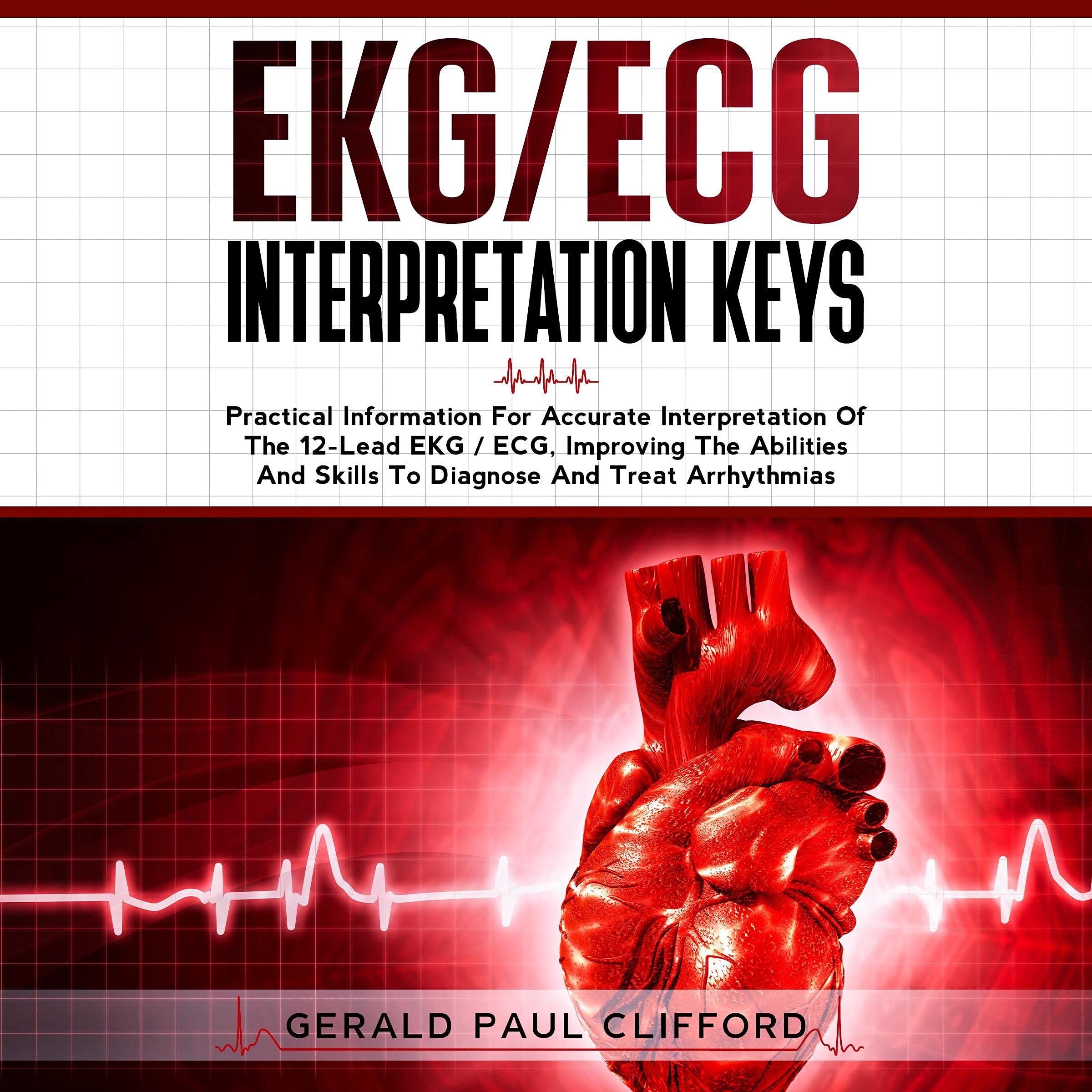 Buy EKG/ECG Interpretation Keys: Practical Information for Accurate ...
