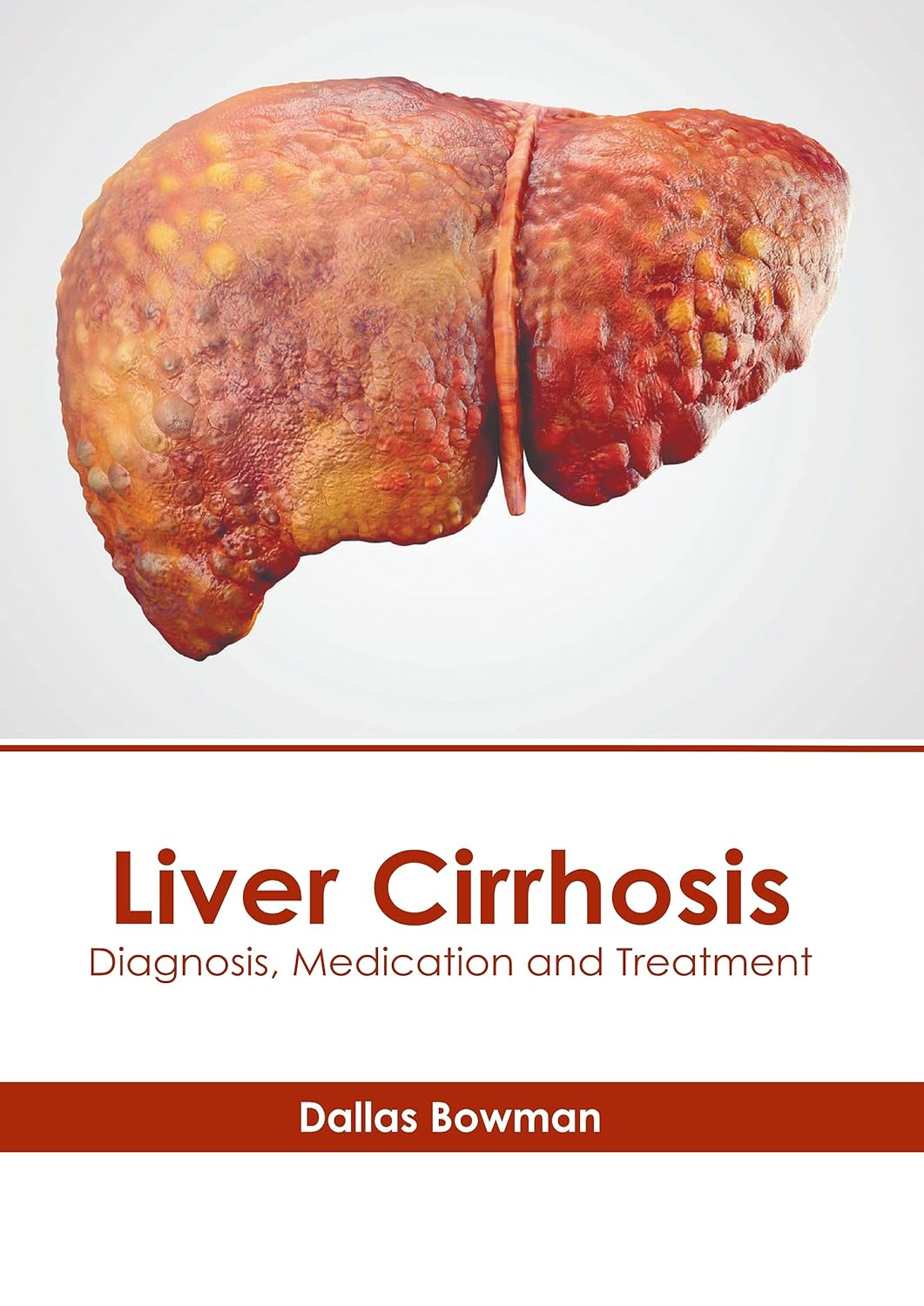 Buy Liver Cirrhosis: Diagnosis, Medication and Treatment Book Online at ...