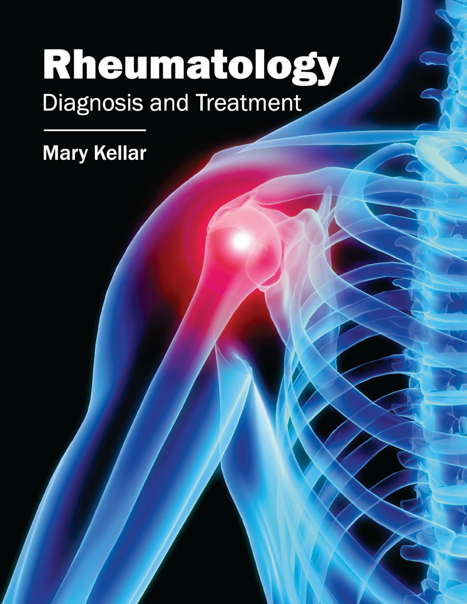 Rheumatology: Diagnosis and Treatment: 9781632424372: Medicine & Health ...