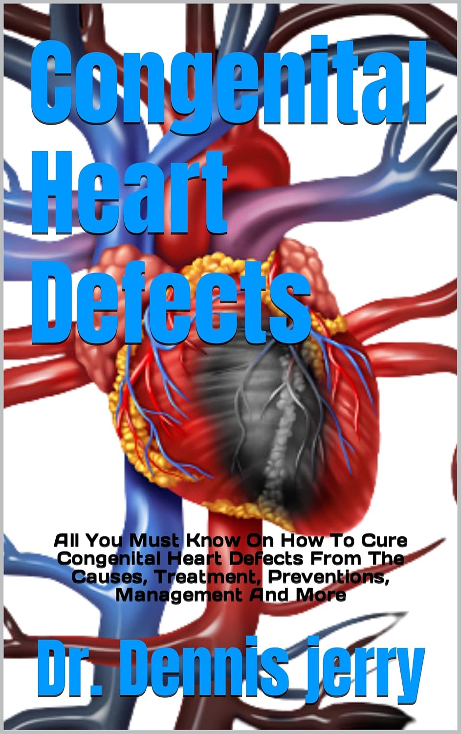 Congenital Heart Defects : All You Must Know On How To Cure Congenital ...