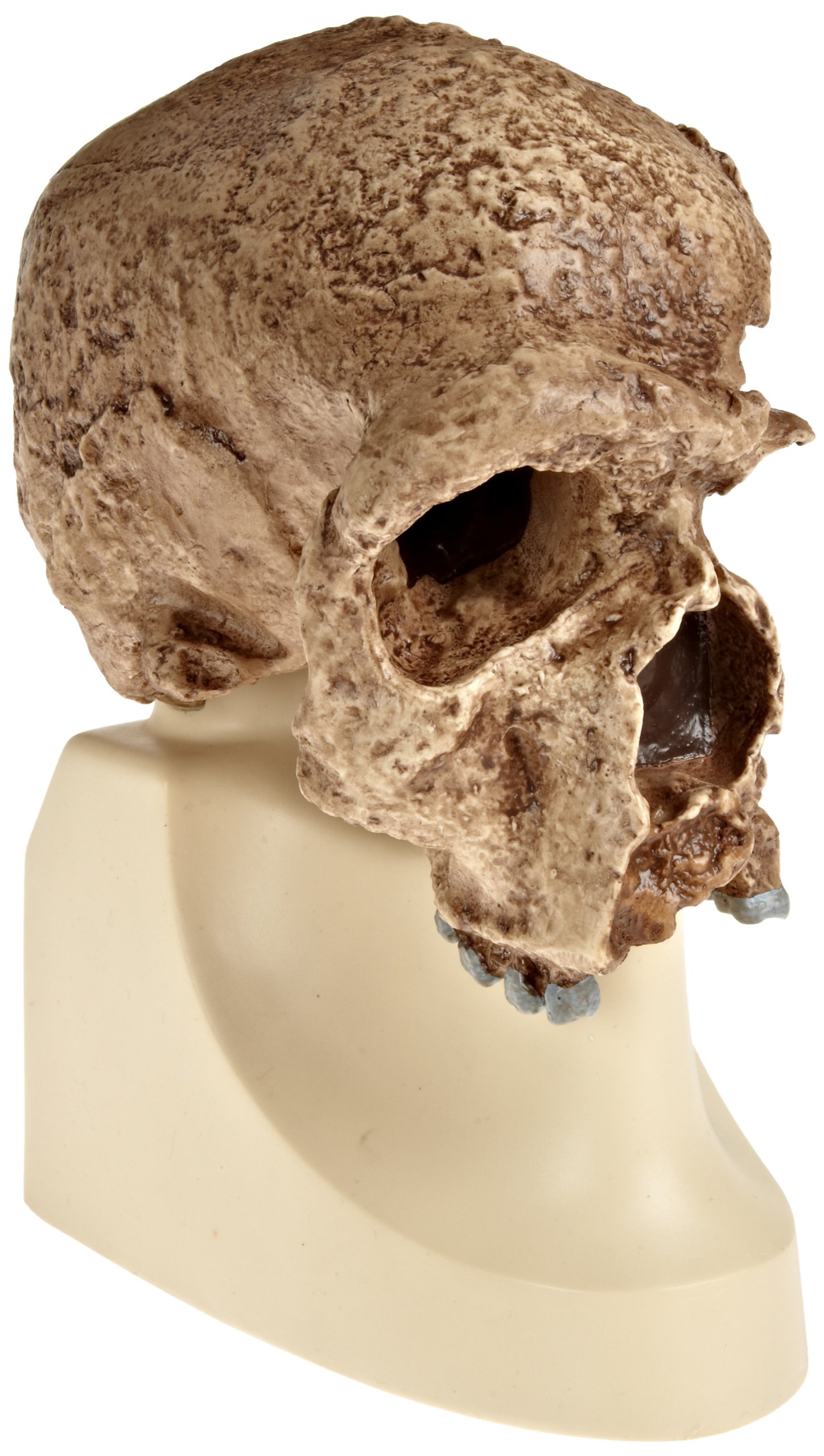 3B Scientific VP753/1 Steinheim Anthropological Skull Model, 7.5" x 4.9 ...