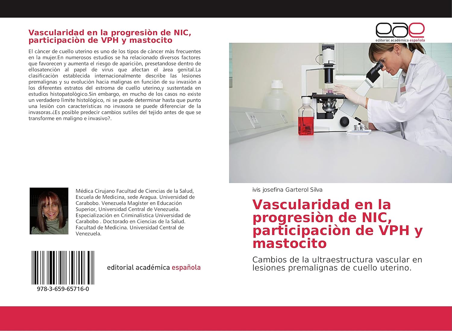 Vascularidad en la progresión de NIC, participación de VPH y mastocito ...