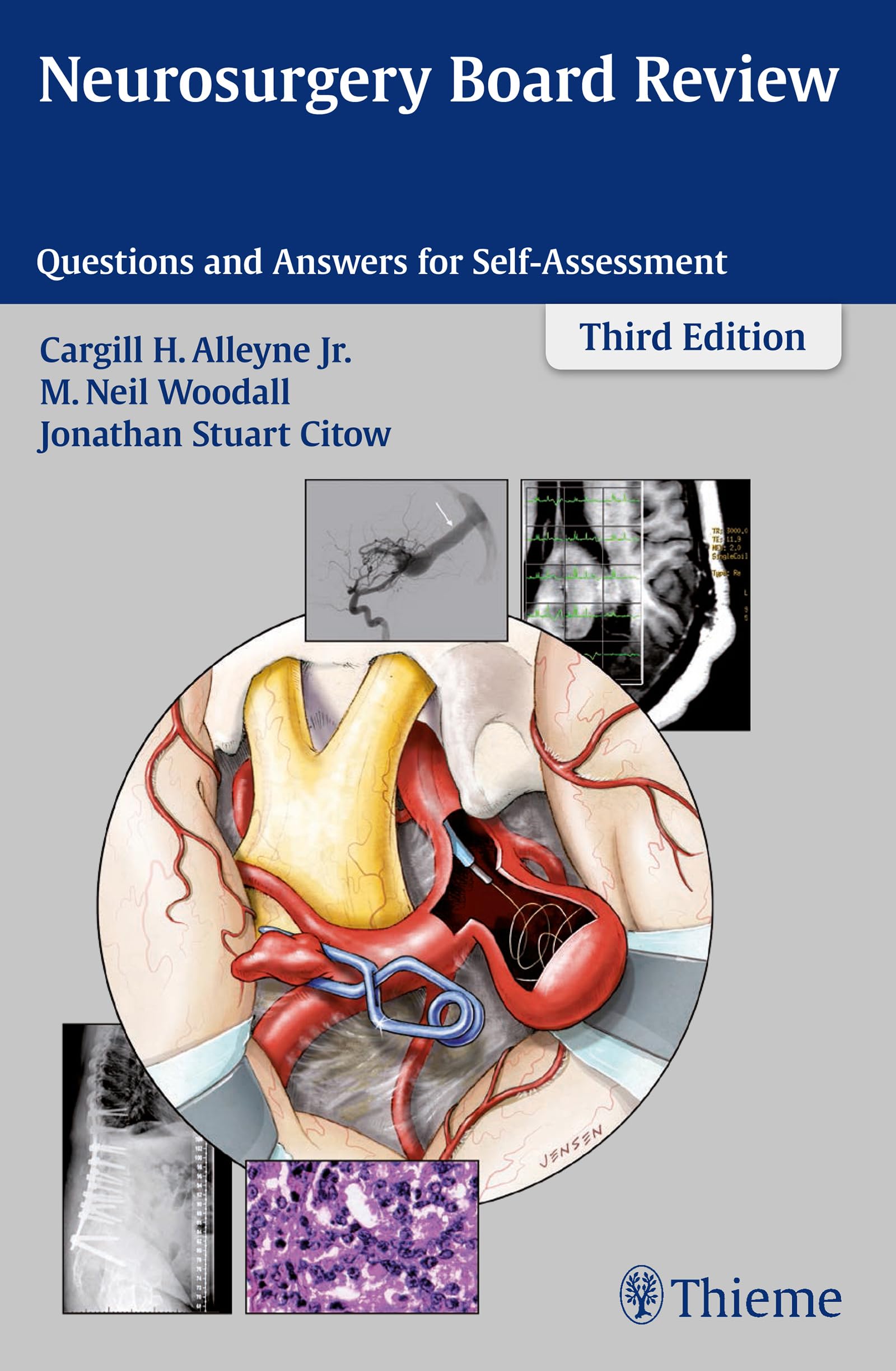 Neurosurgery Board Review: Questions and Answers for Self-Assessment ...