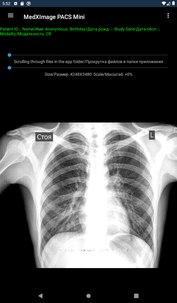 MedXImage PACS Mini - App on Amazon Appstore