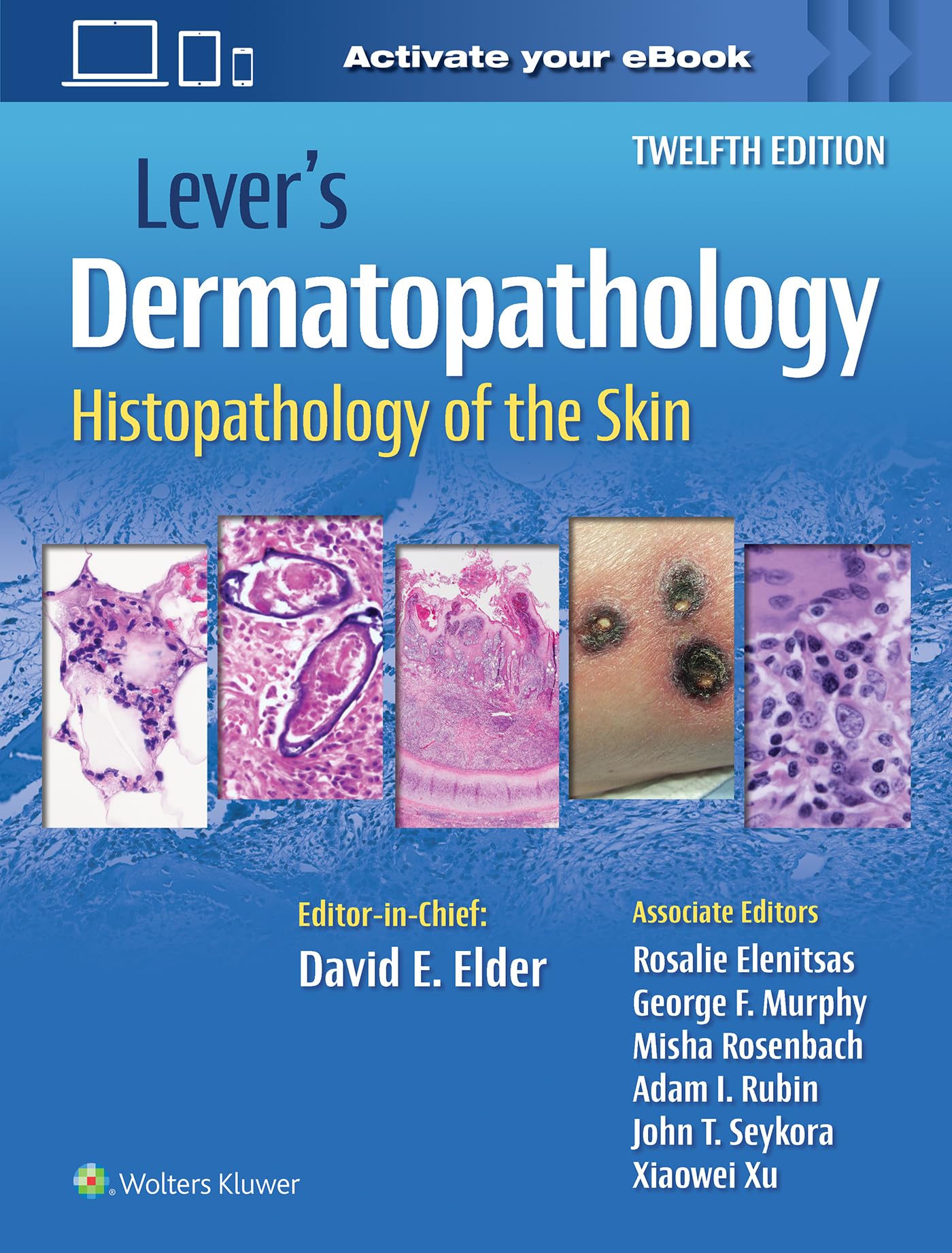 Lever's Dermatopathology: Histopathology of the Skin: 9781975174491 ...
