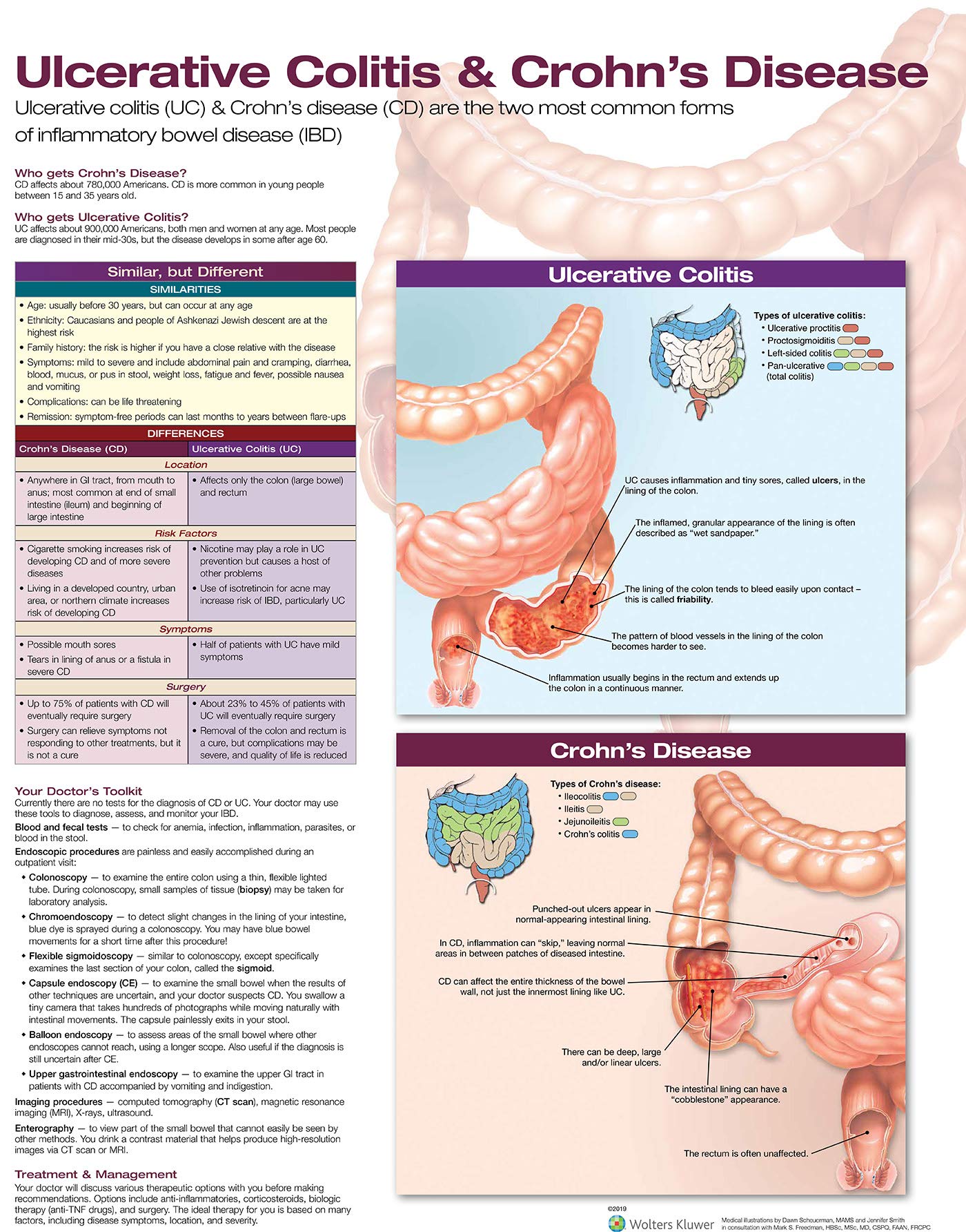 Buy Ulcerative Colitis & Crohn's Disease Anatomical Chart Laminated ...