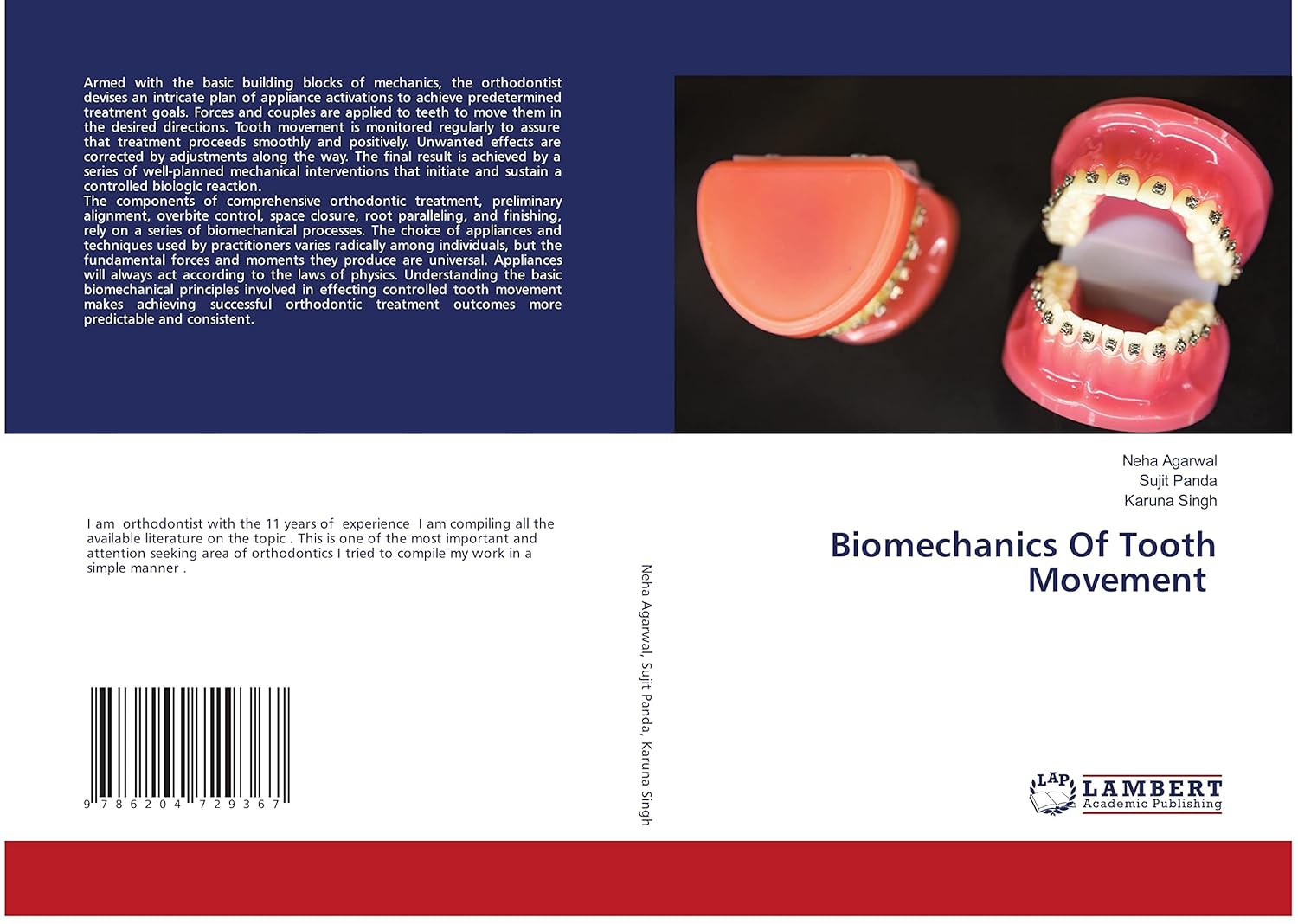 Biomechanics Of Tooth Movement: 9786204729367: Medicine & Health ...