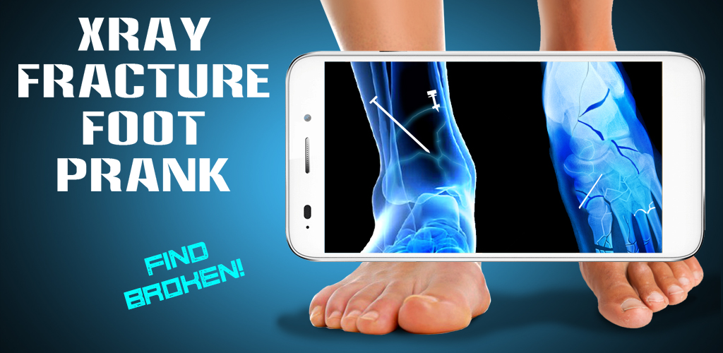 X Ray Fracture Foot Prank - App on Amazon Appstore