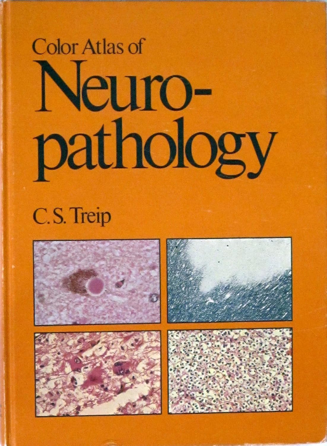 Color Atlas of Neuropathology: C.S. Treip: 9780815188414: Amazon.com: Books
