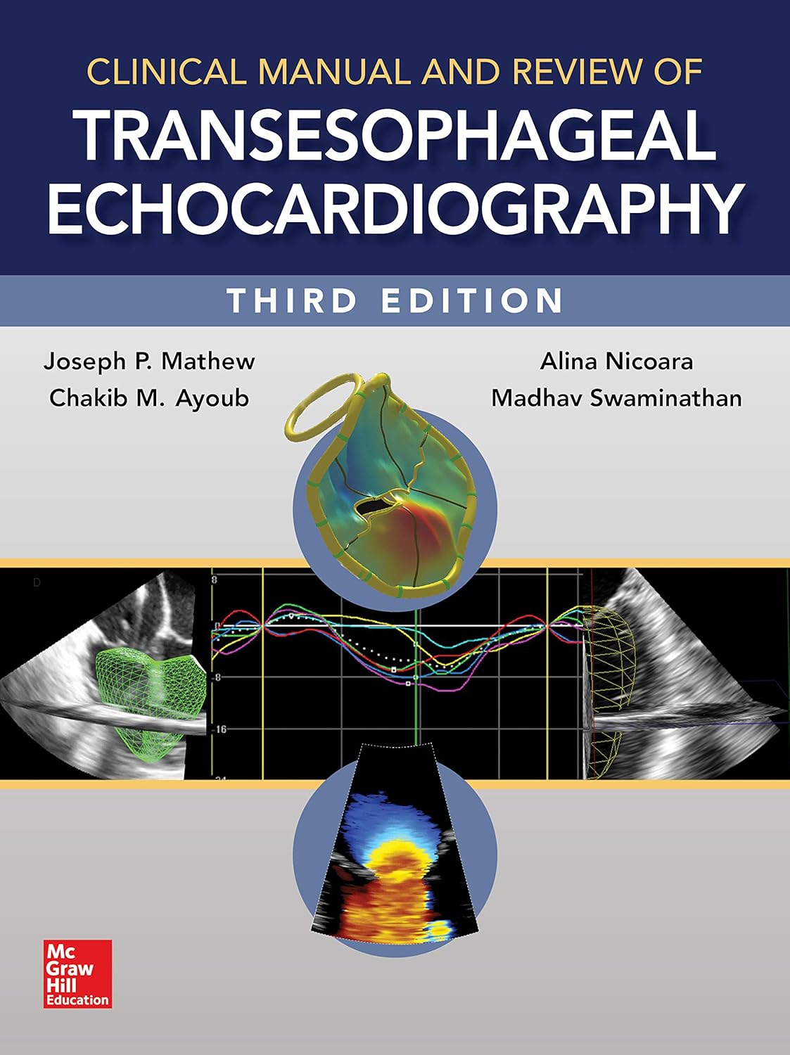 Clinical Manual and Review of Transesophageal Echocardiography, 3/e ...