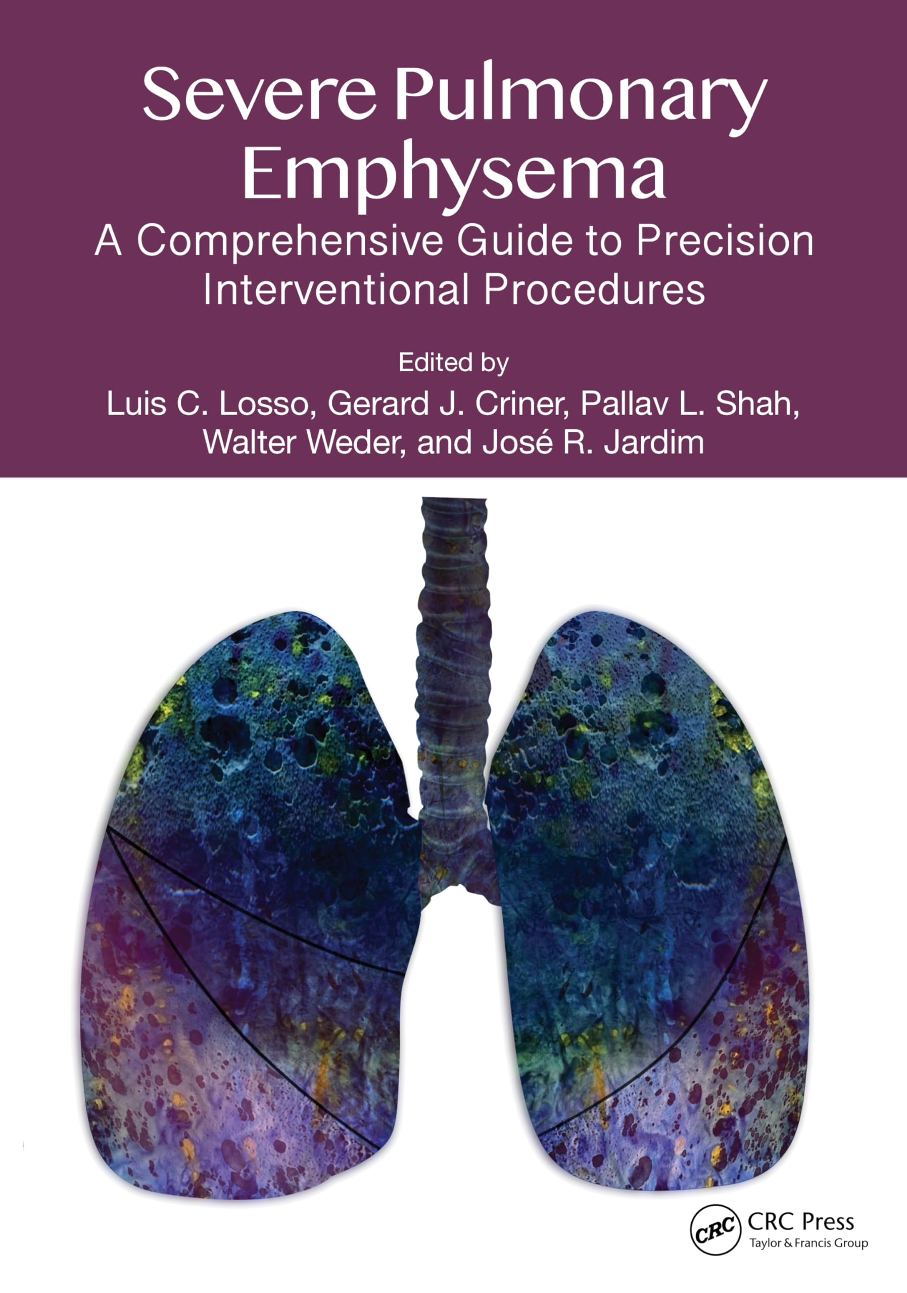 Severe Pulmonary Emphysema: A Comprehensive Guide to Precision ...
