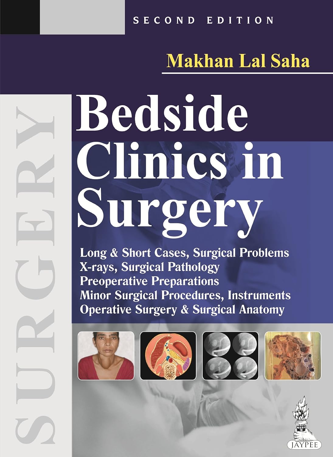 Bedside Clinics in Surgery: Long and Short Cases, Surgical Problems, X ...