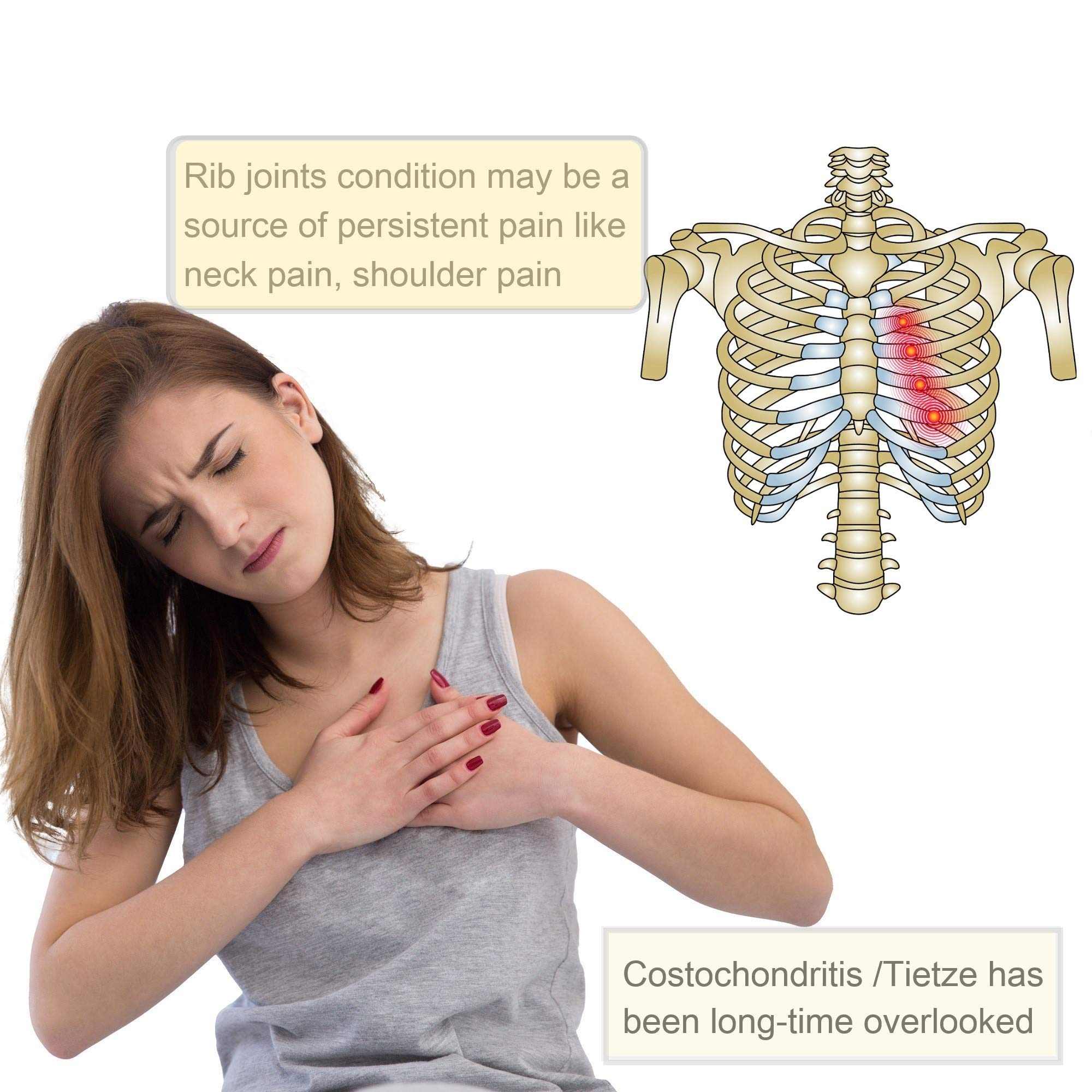 Costochondritis From Bench Press at Steven Wooten blog