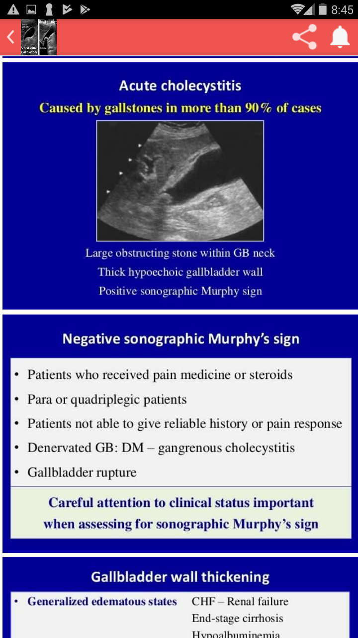 Murphys Sign Gallbladder