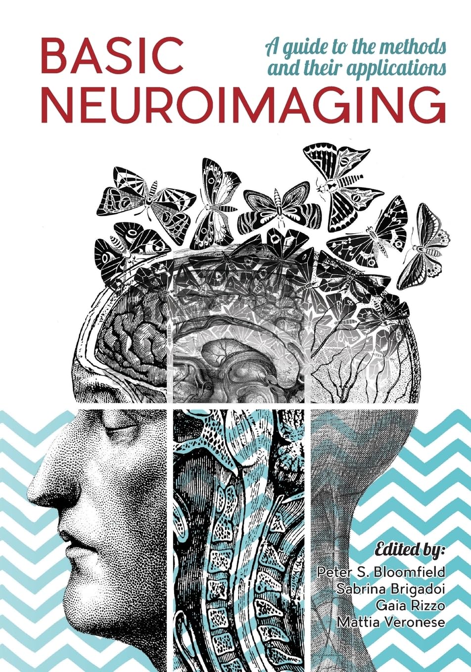 Basic Neuroimaging: A guide to the methods and their applications ...