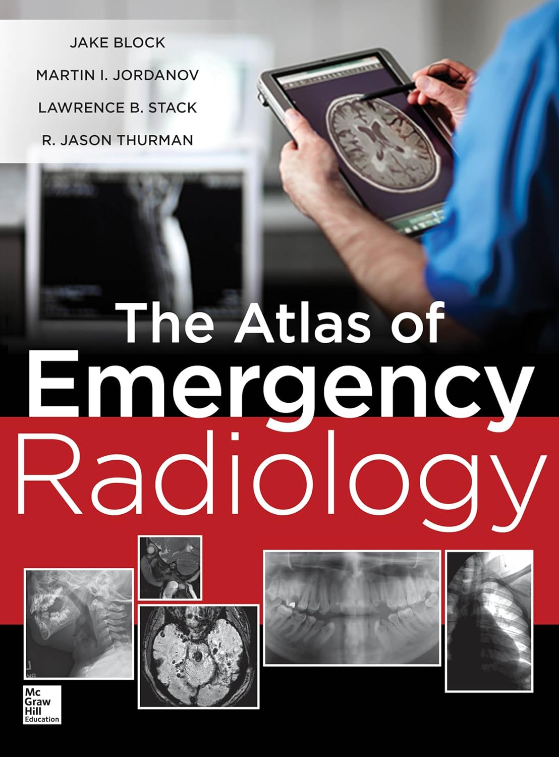 Amazon.com: Atlas of Emergency Radiology eBook : Block, Jake, Jordanov ...