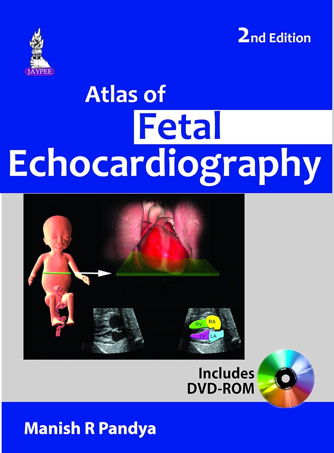 Atlas of Fetal Echocardiography: 0009351524760: Medicine & Health ...