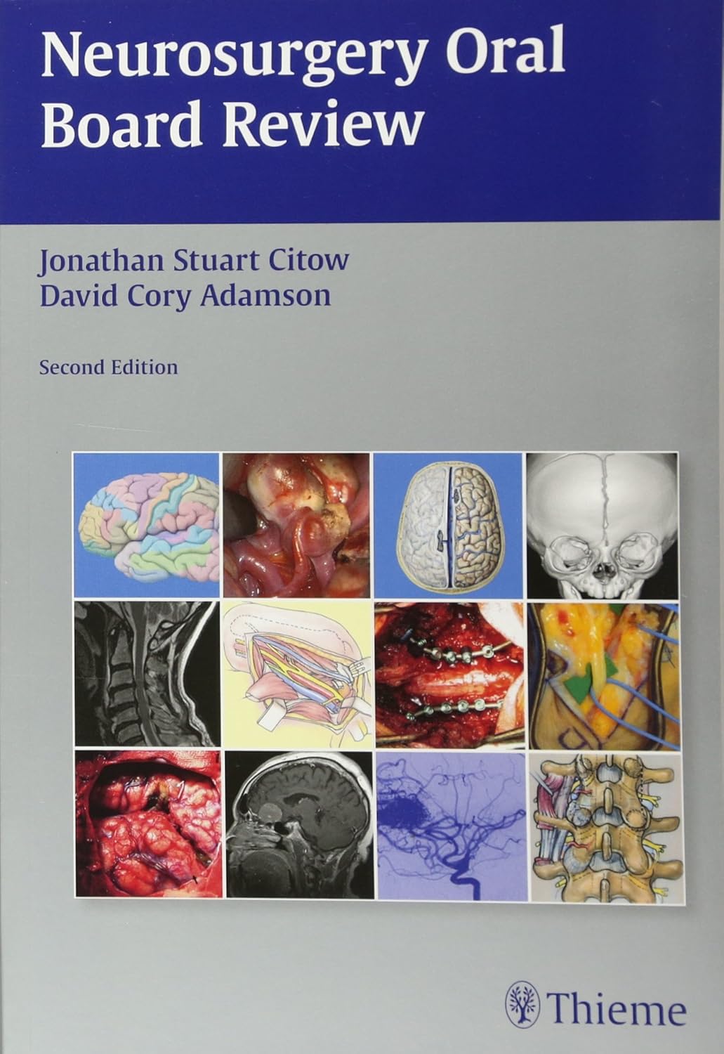 Neurosurgery Oral Board Review: 9781604065404: Medicine & Health ...