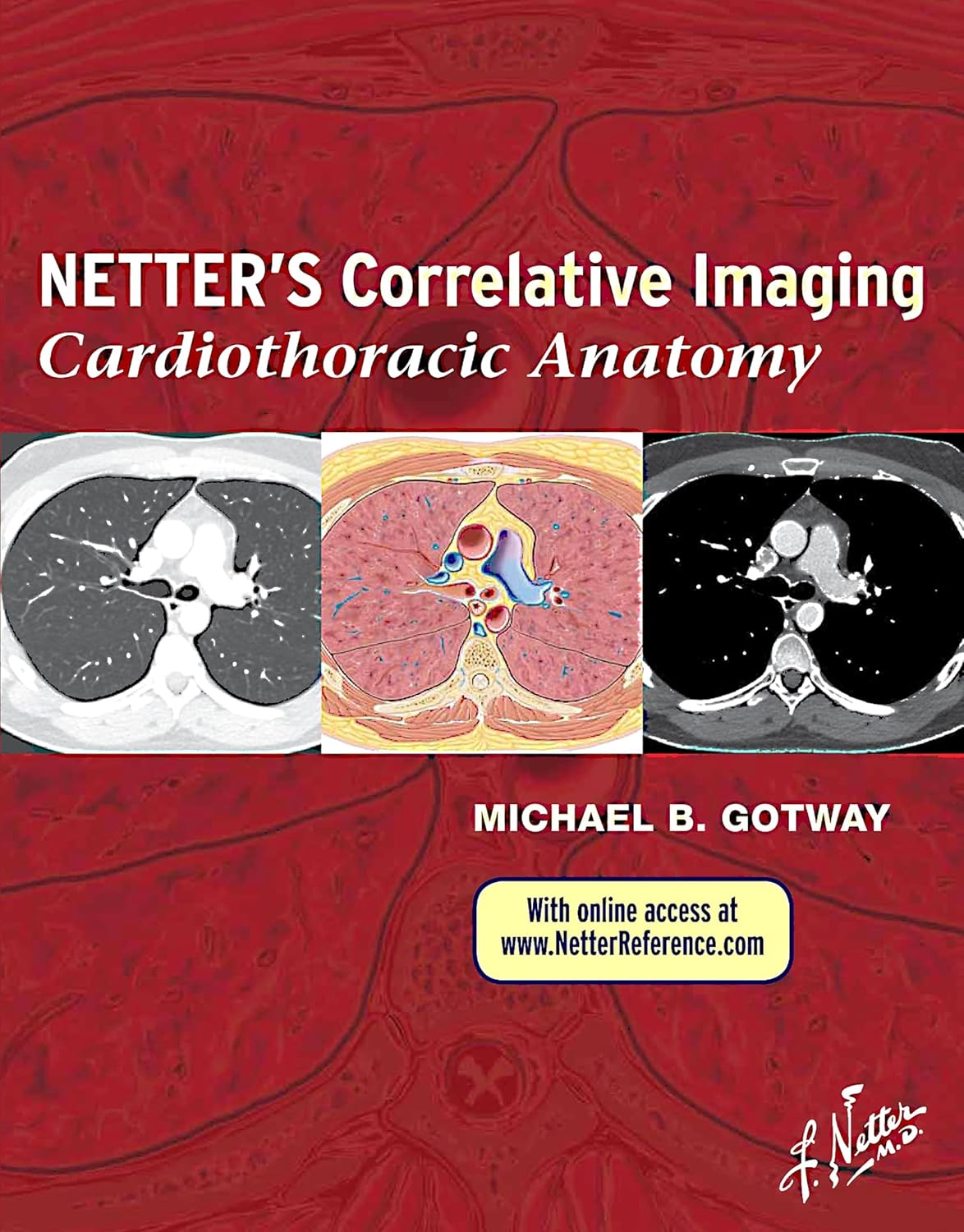 Amazon.com: Netter's Correlative Imaging: Cardiothoracic Anatomy ...