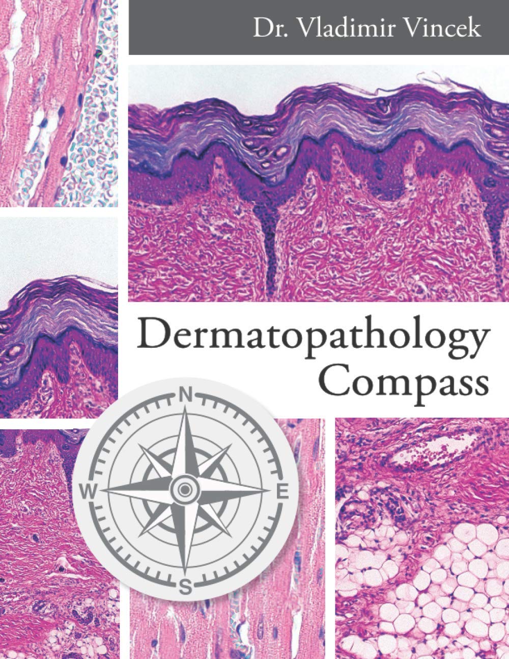 Dermatopathology Compass: Vincek, Dr. Vladimir: 9780578836744: Amazon ...