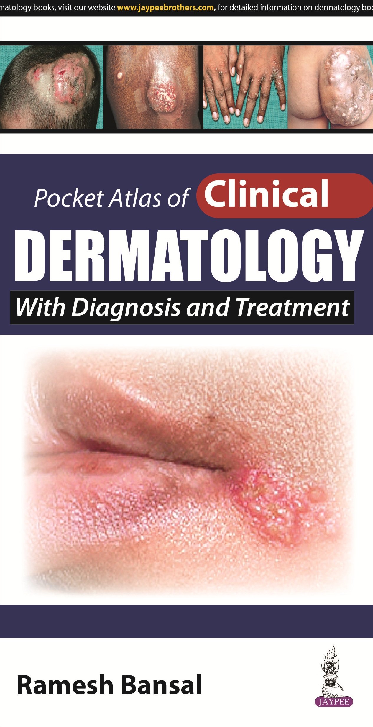 Pocket Atlas of Clinical Dermatology With Diagnosis and Treatment ...