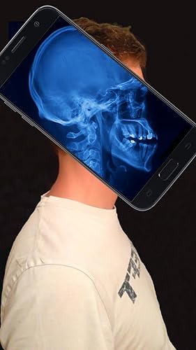 Real Xray Body Scan Filter Cam:Amazon.com:Appstore for Android