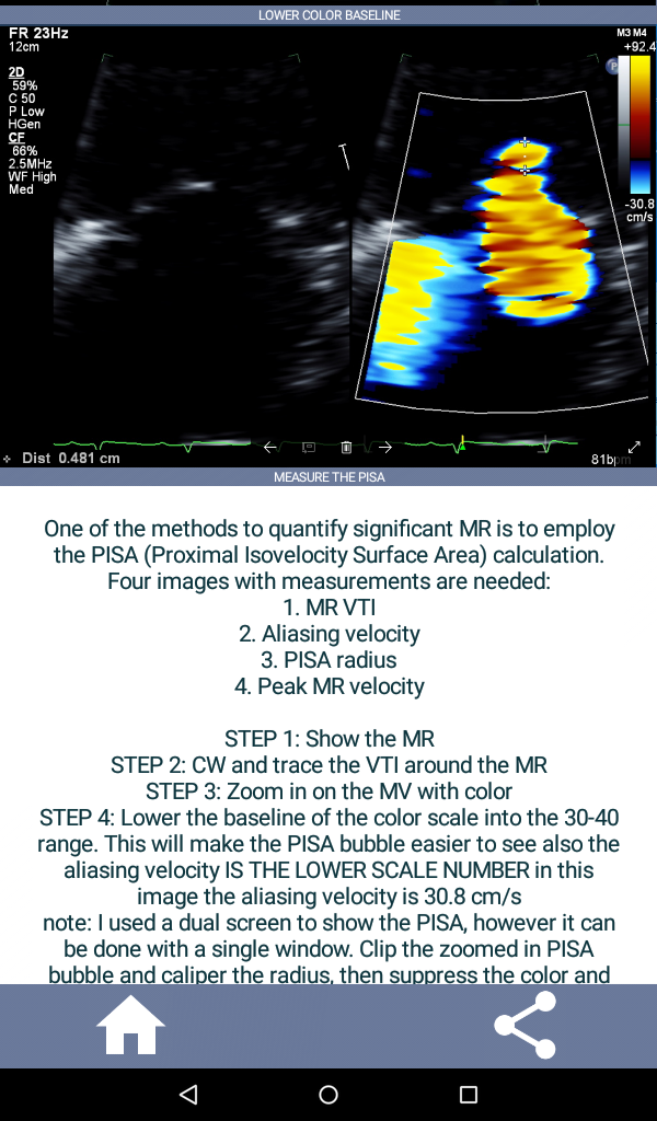 LEARN THE FULL TTE ECHO ULTRASOUND PROTOCOL DEMO - App on Amazon Appstore