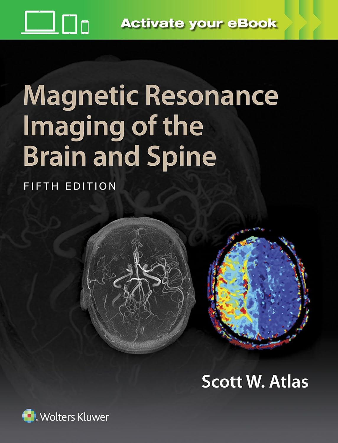 Magnetic Resonance Imaging of the Brain and Spine: 9781469873206 ...