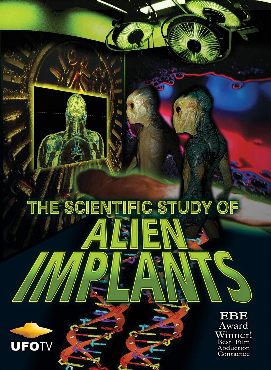 Amazon.co.jp: Scientific Study of Alien Implants [DVD] [Import] : DVD