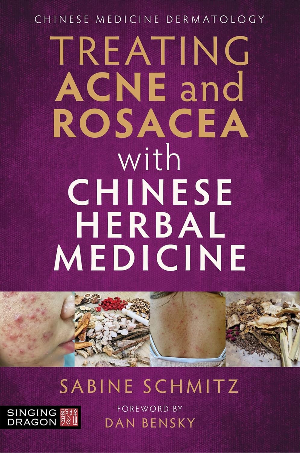 Treating Acne and Rosacea With Chinese Herbal Medicine: Schmitz, Sabine ...