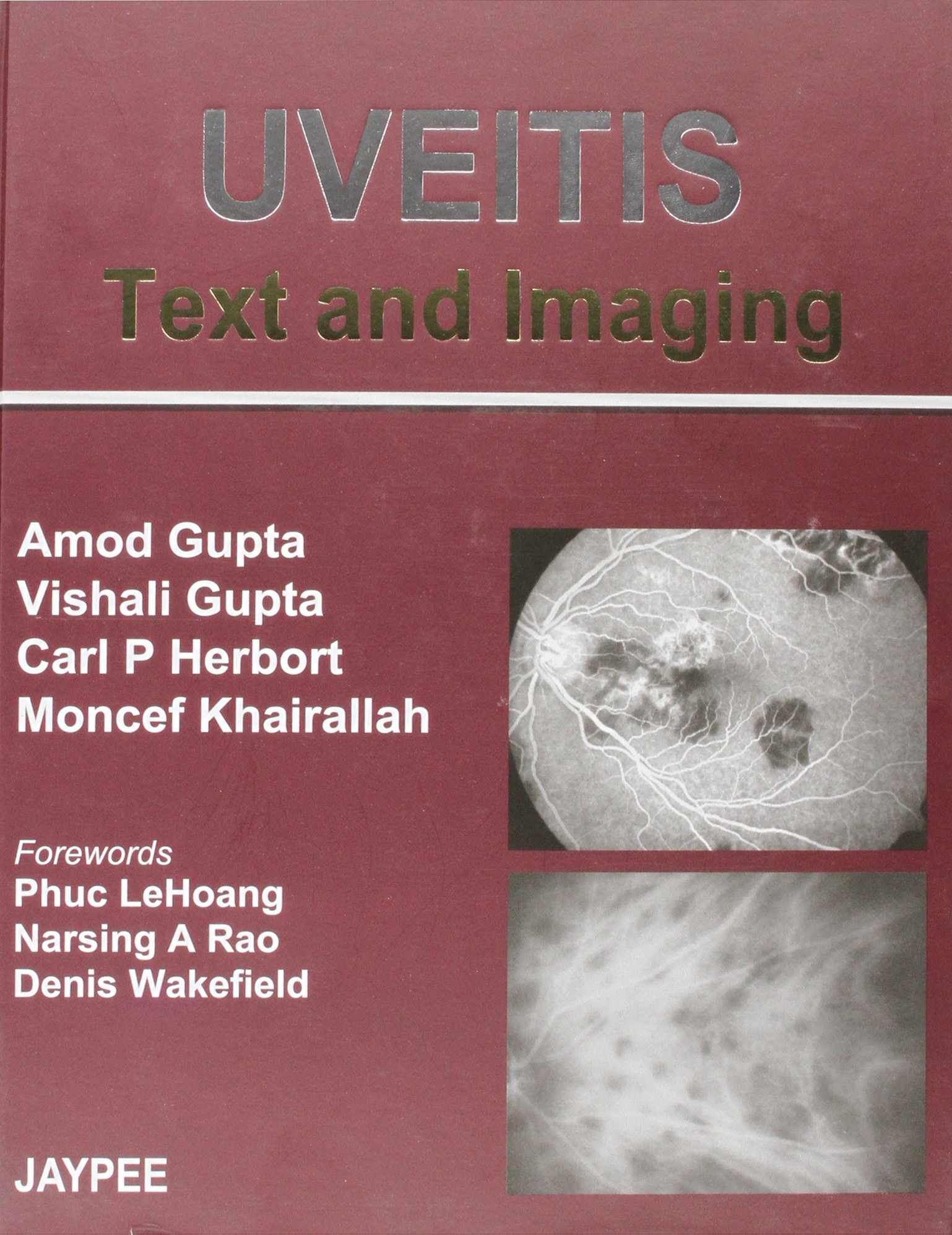 Buy UVEITIS Text and Imaging Book Online at Low Prices in India ...