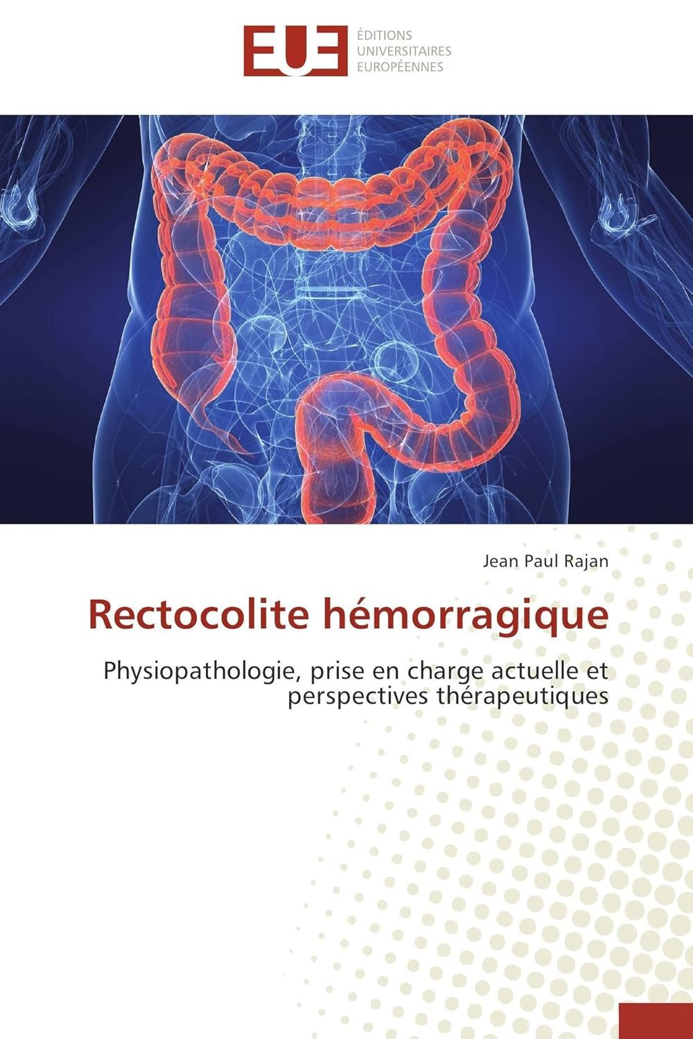 Rectocolite hémorragique: Physiopathologie, prise en charge actuelle et ...