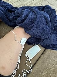 Amazon.com: TENS Unit & EMS Muscle Stimulator for Pain Relief Therapy ...